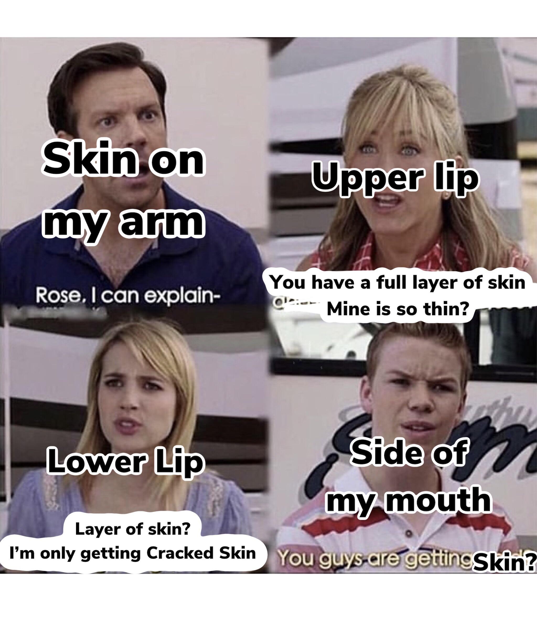 Me losing a stick of lip balm every day | Scrolller