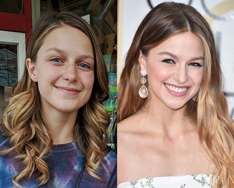 Melissa Benoist Comparison | Scrolller