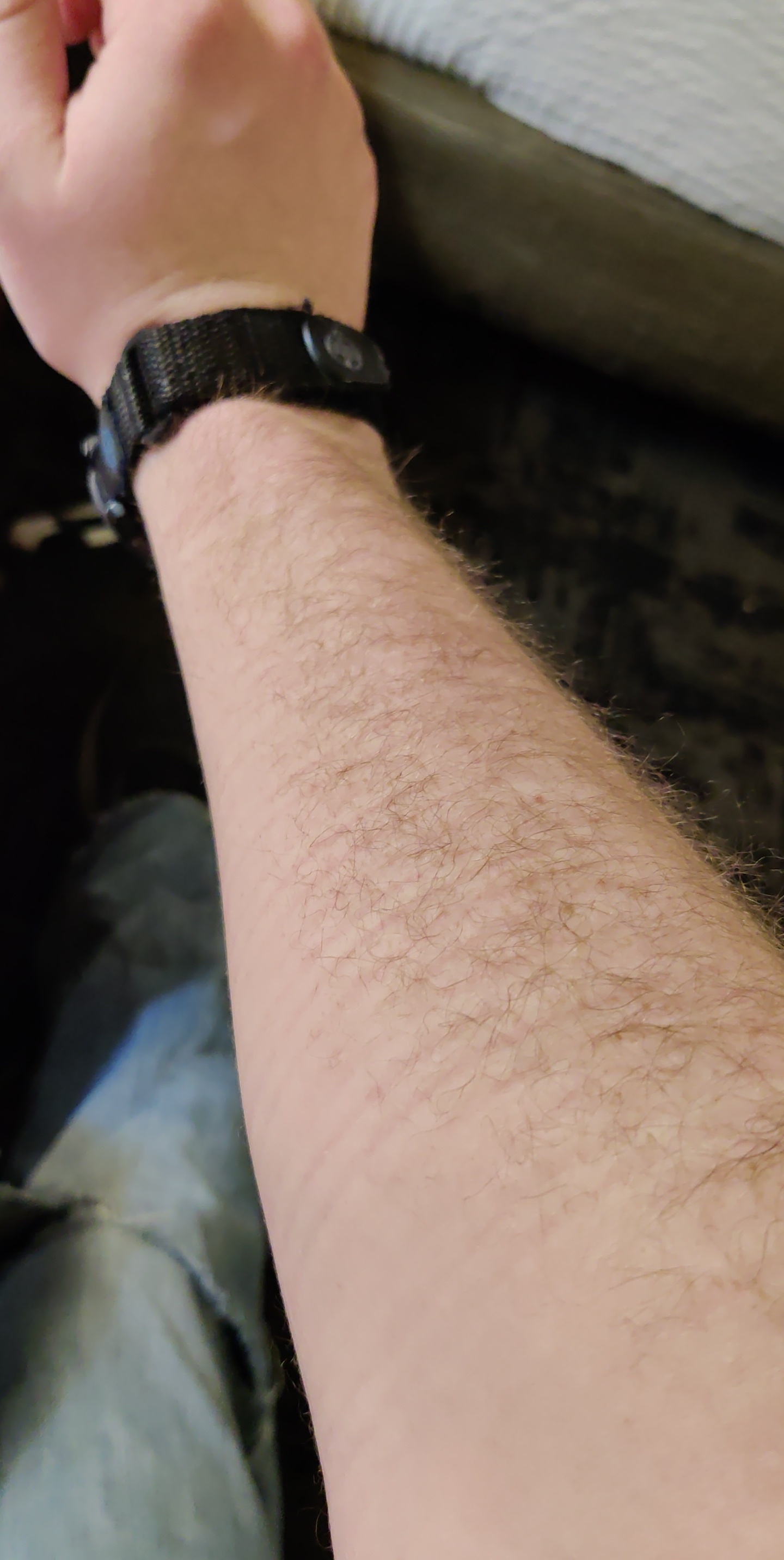 My arm after taking off my tight undershirt | Scrolller