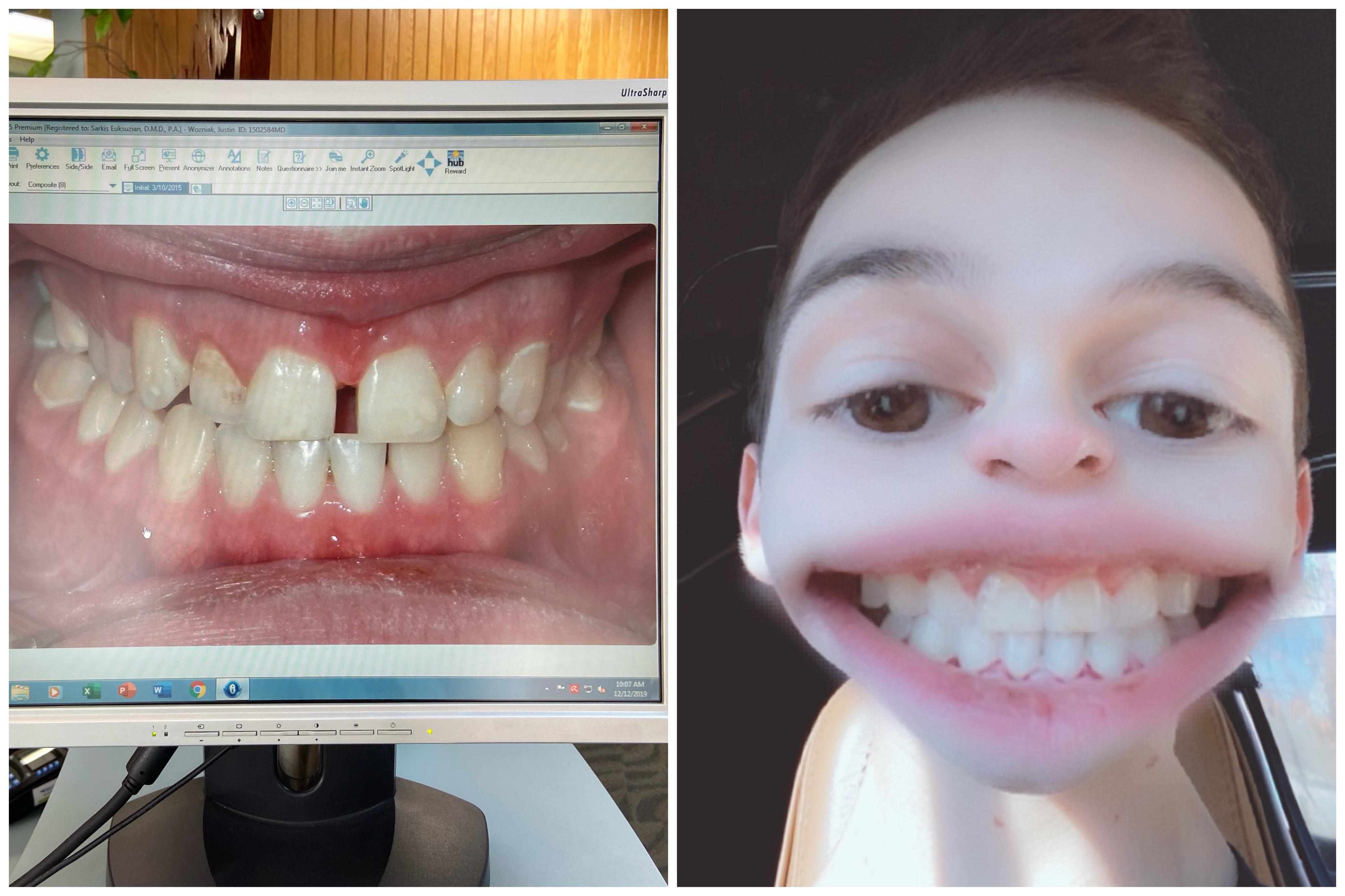 My before and after! | Scrolller