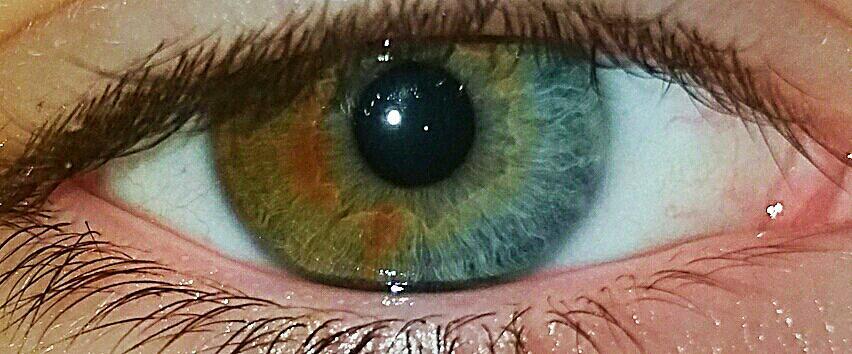 My e y e | Scrolller