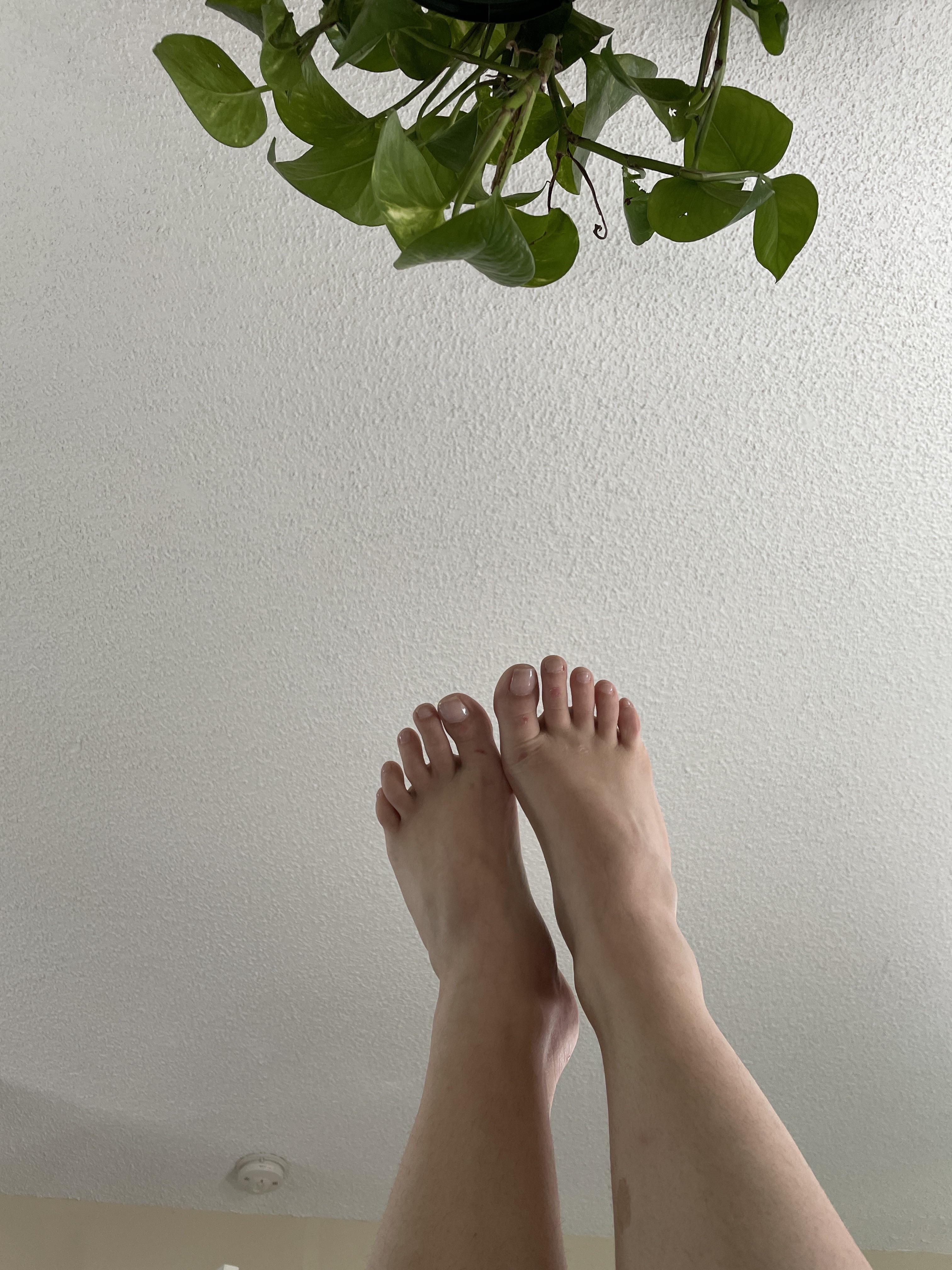 My feet need some attention | Scrolller