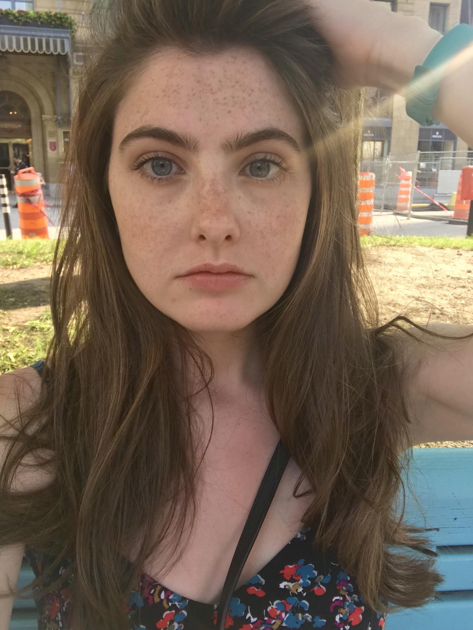 My freckle face | Scrolller