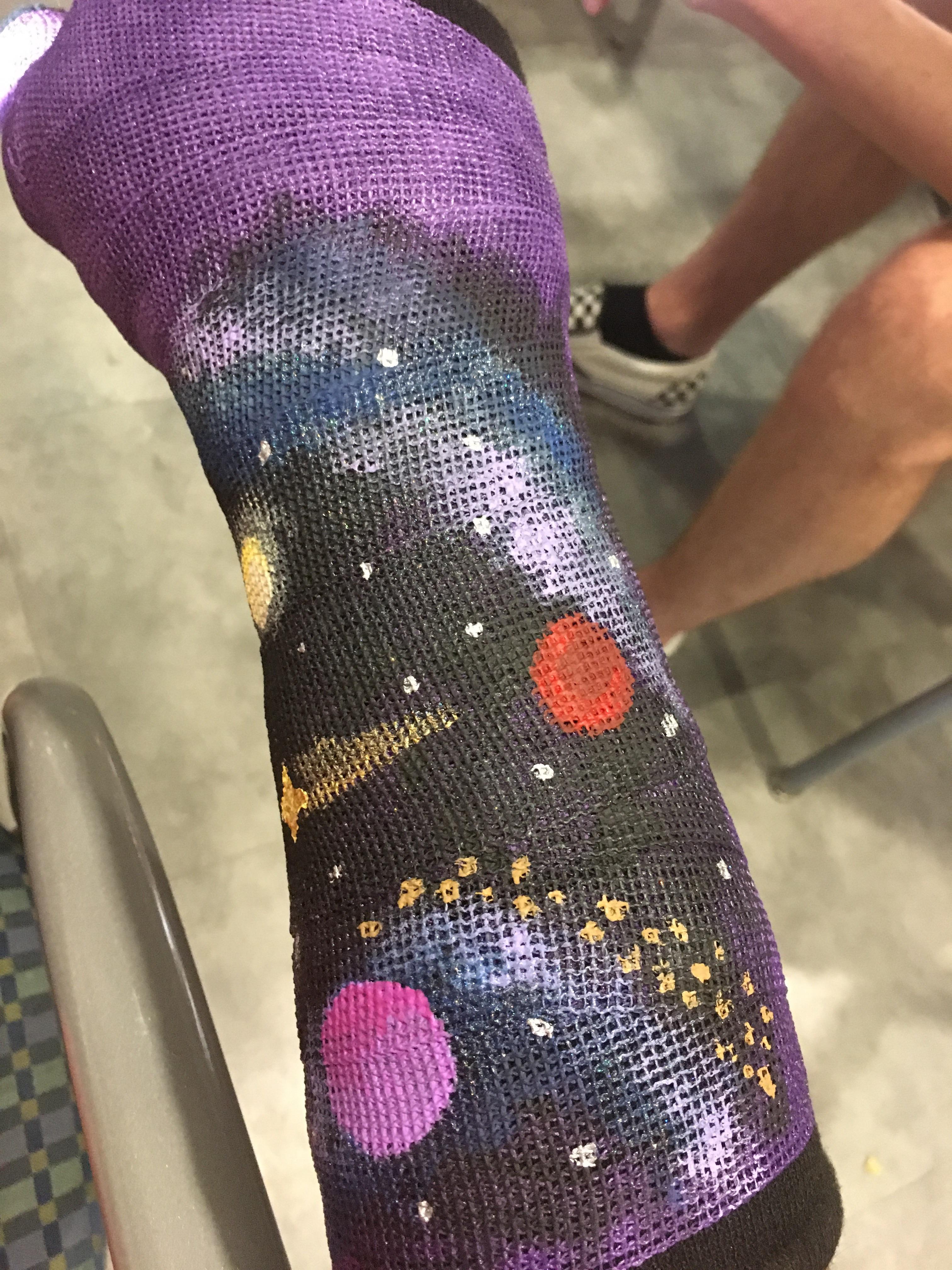 My friend painted my cast | Scrolller