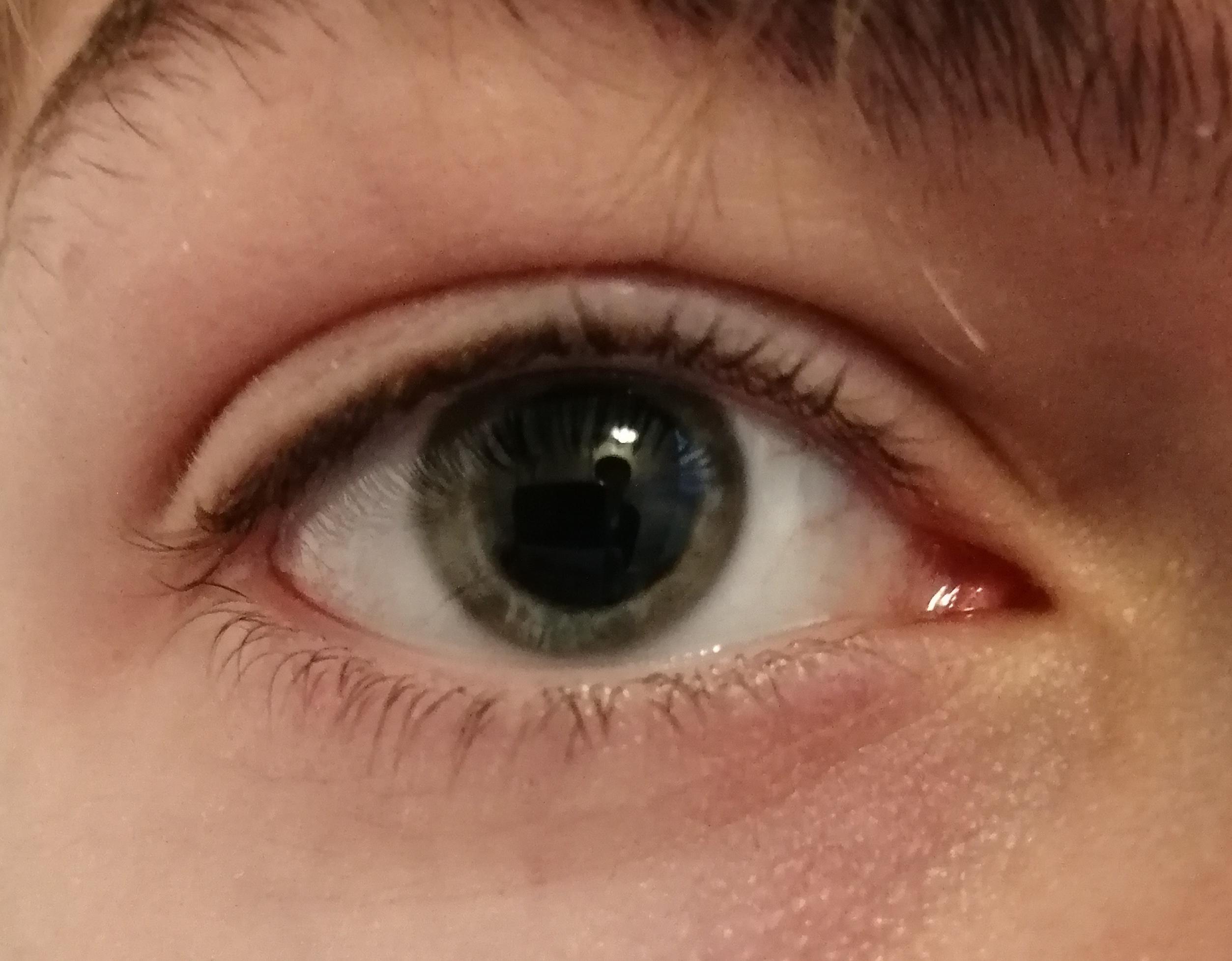 My pupils are naturally dilated | Scrolller