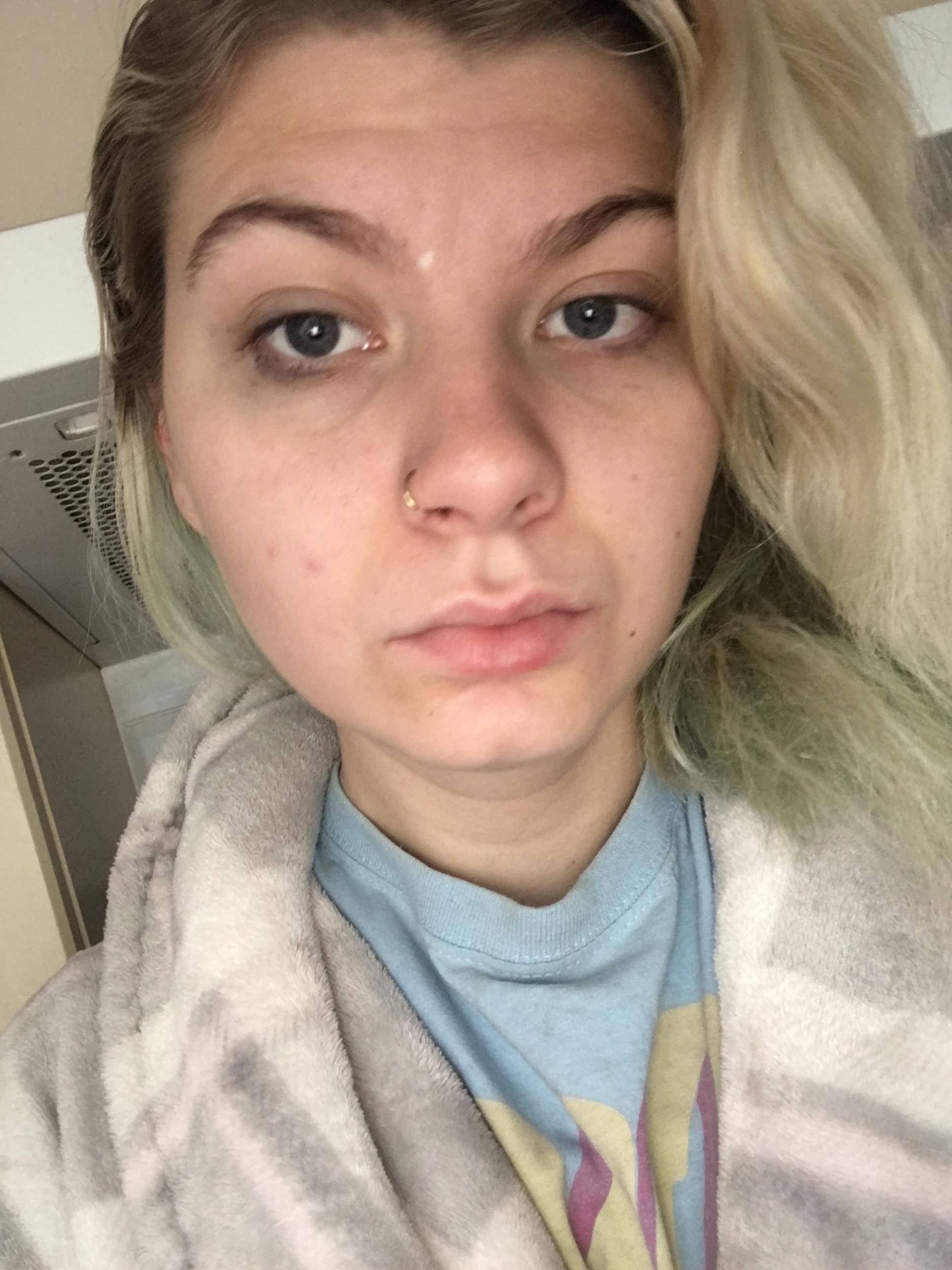 My skins not great atm | Scrolller