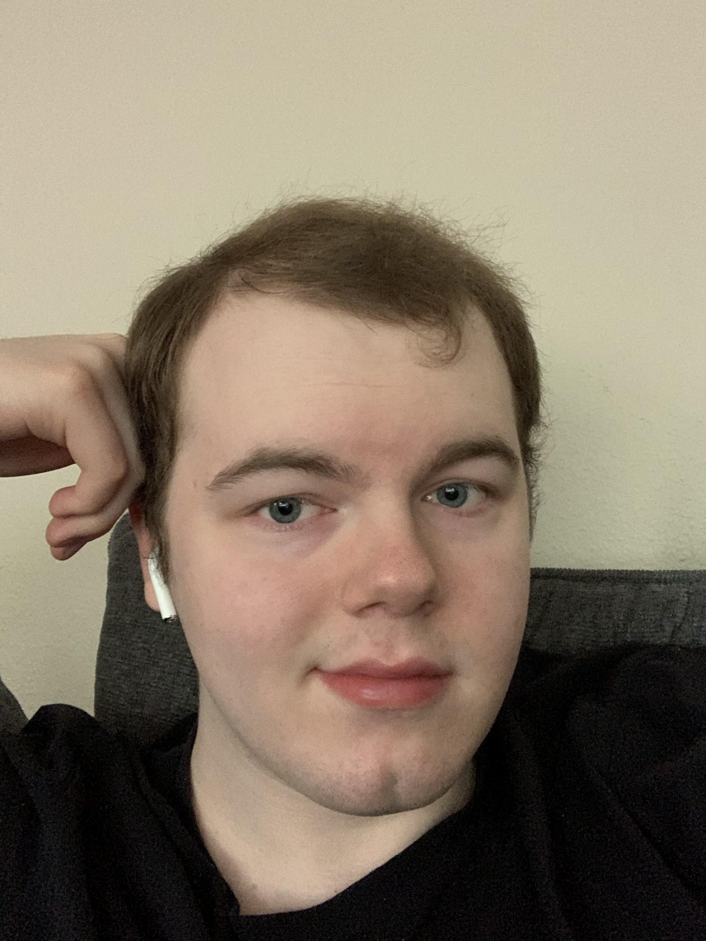Never really liked my face but trying to be more confident. Anything helps | Scrolller
