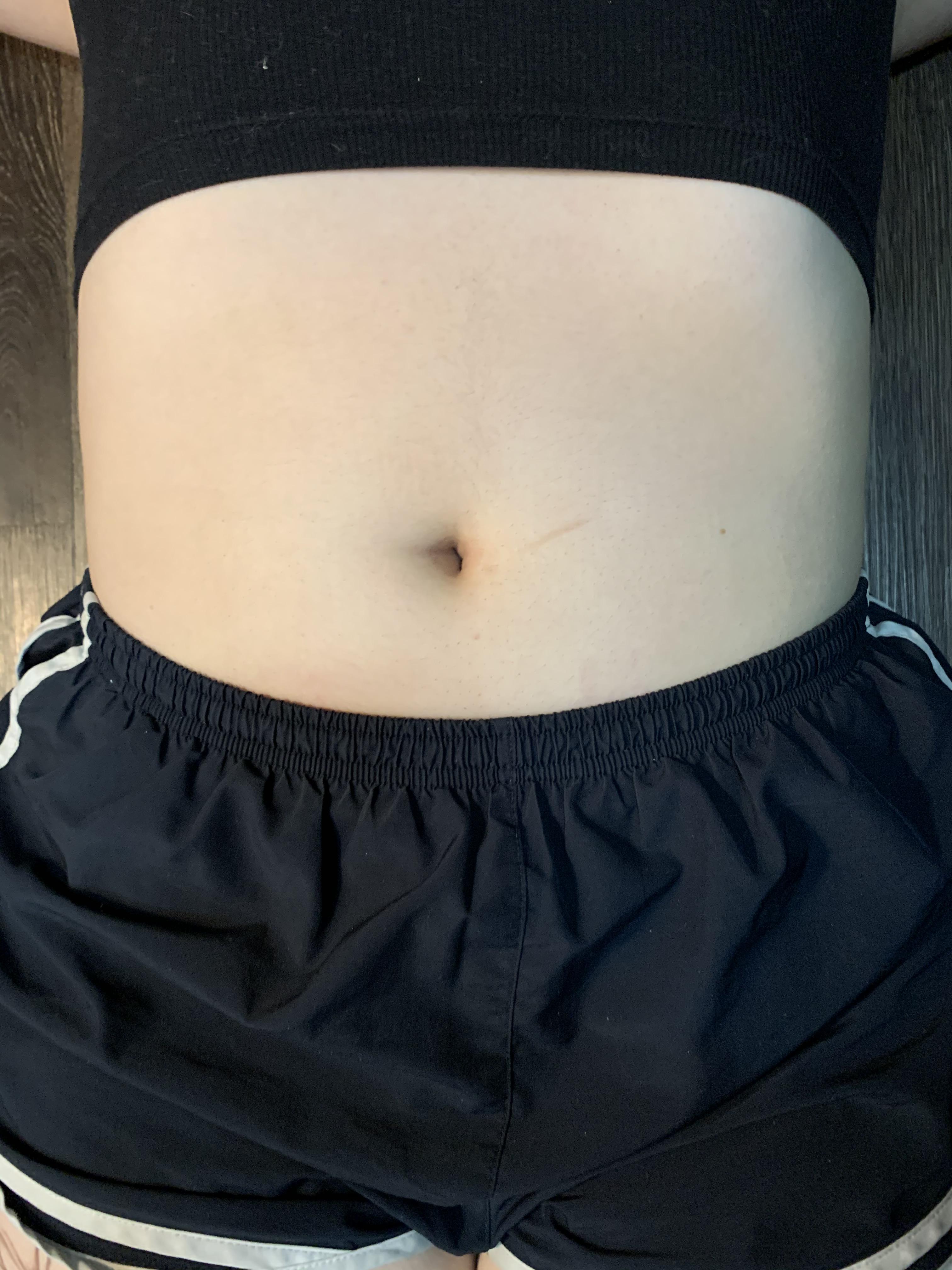New belly button | Scrolller