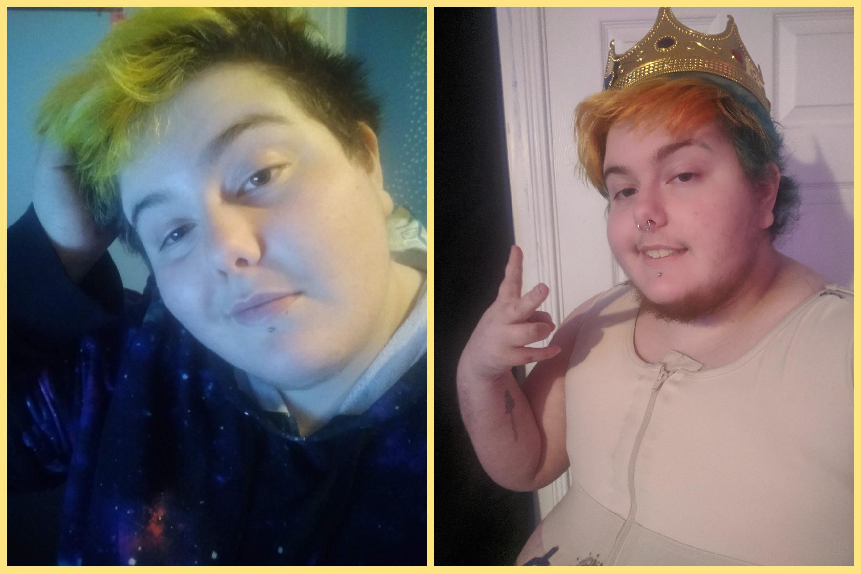 One year of T and a teet yeet later! | Scrolller