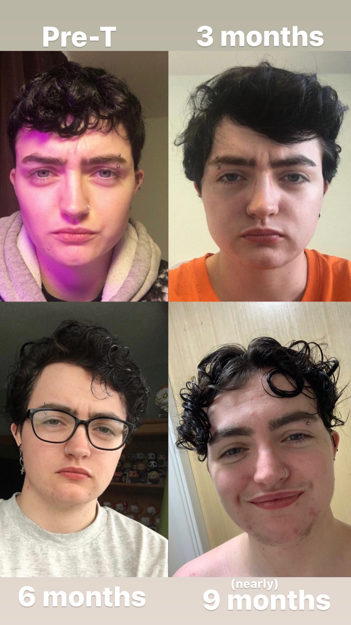 Pre-T to (nearly) 9 months (my voice has changed alot more than my appearance but i did put on ...