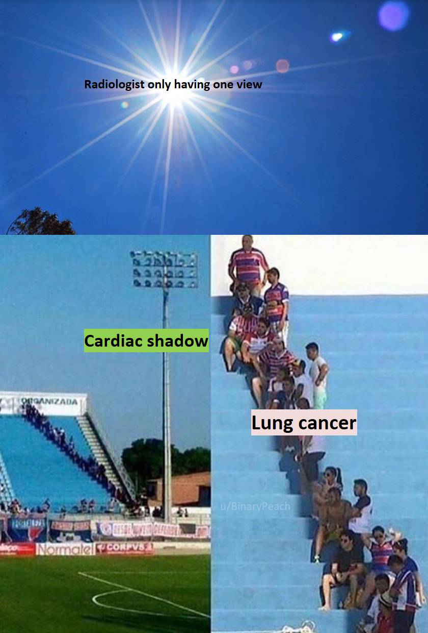 Same [meme], different format. | Scrolller