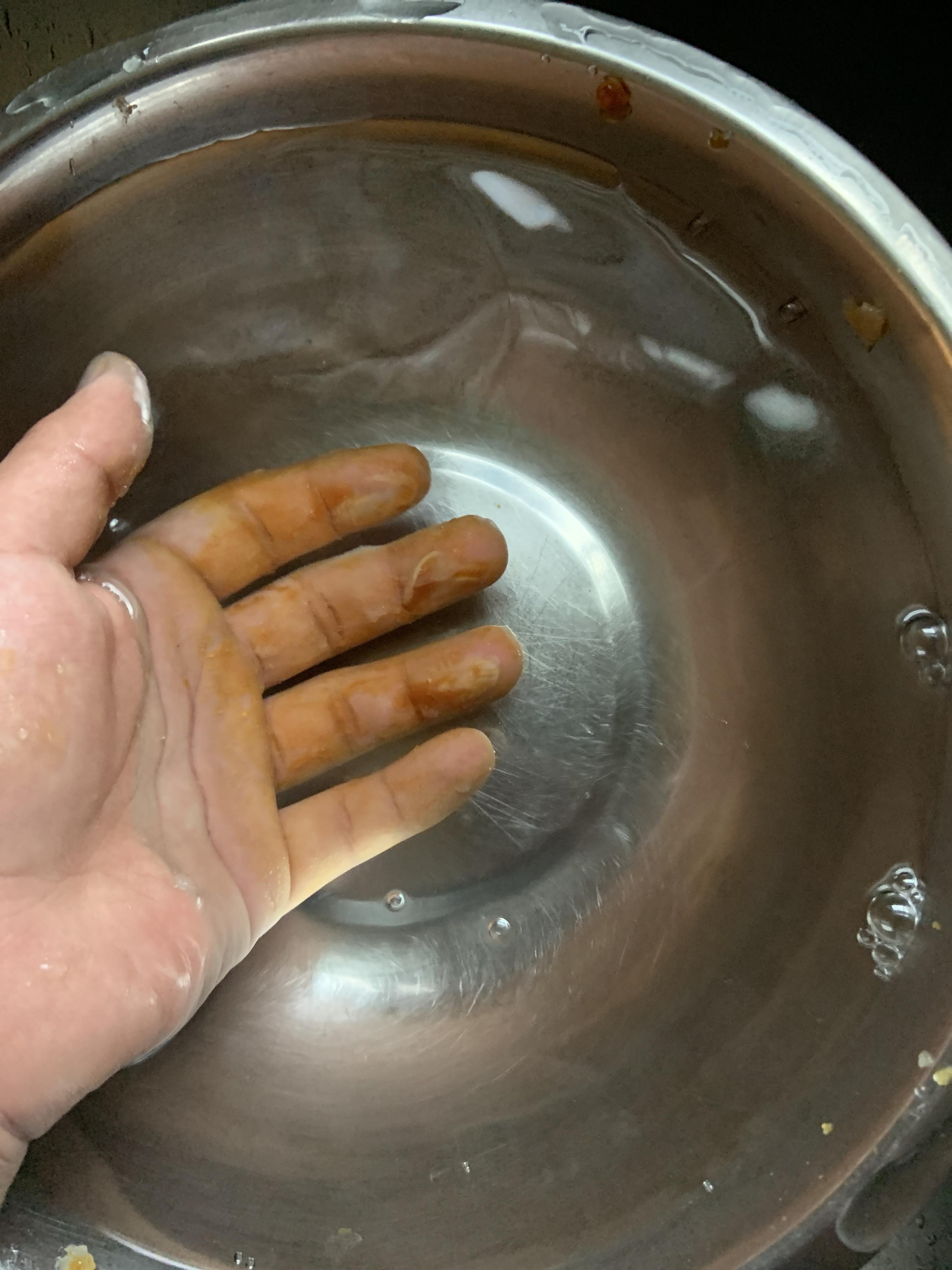 Second degree burn, accidentally touched an engine. Any help | Scrolller