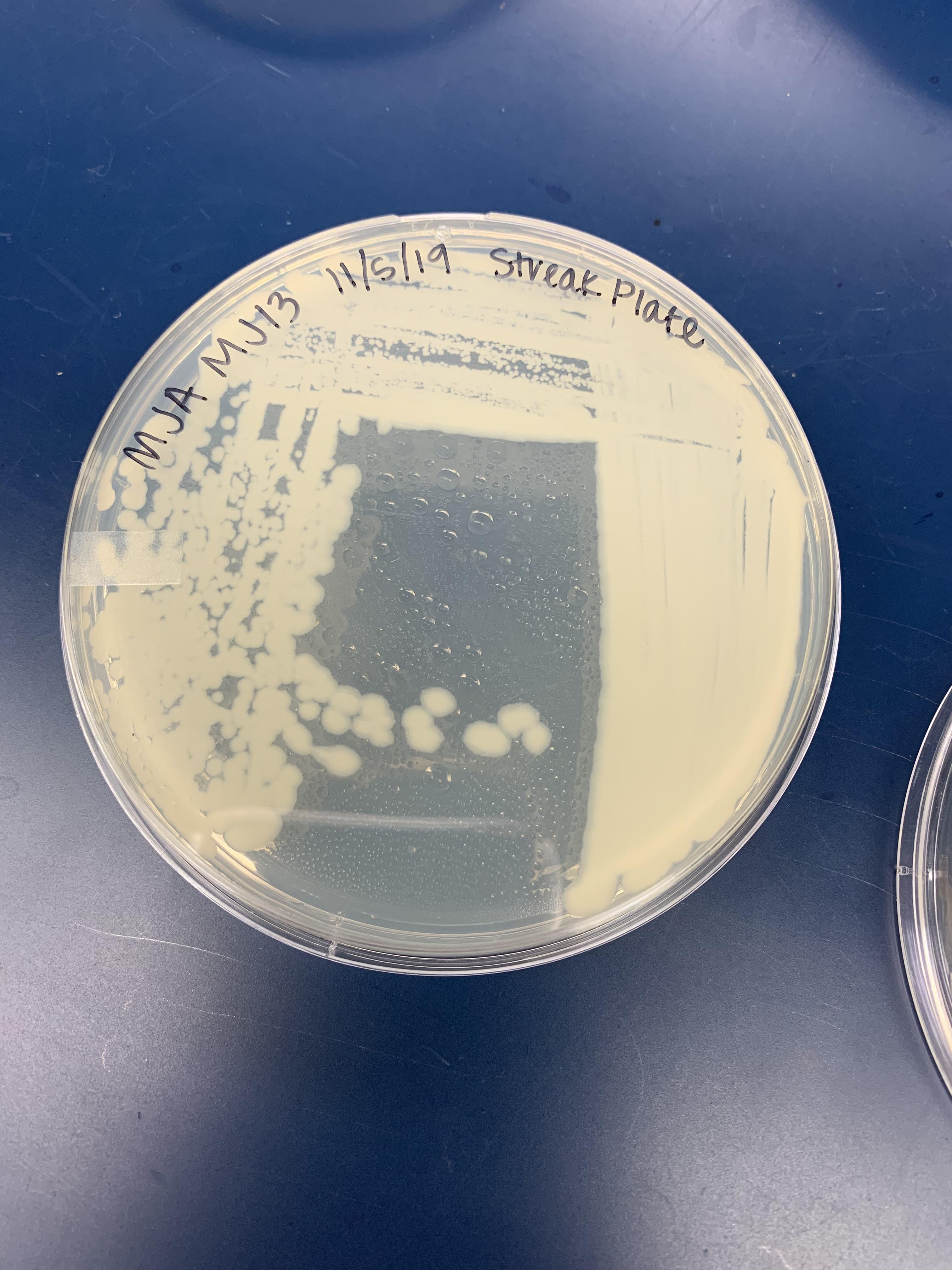 Separating out bacteria to isolate single colonies, it’s called a ‘streak plate’ | Scrolller