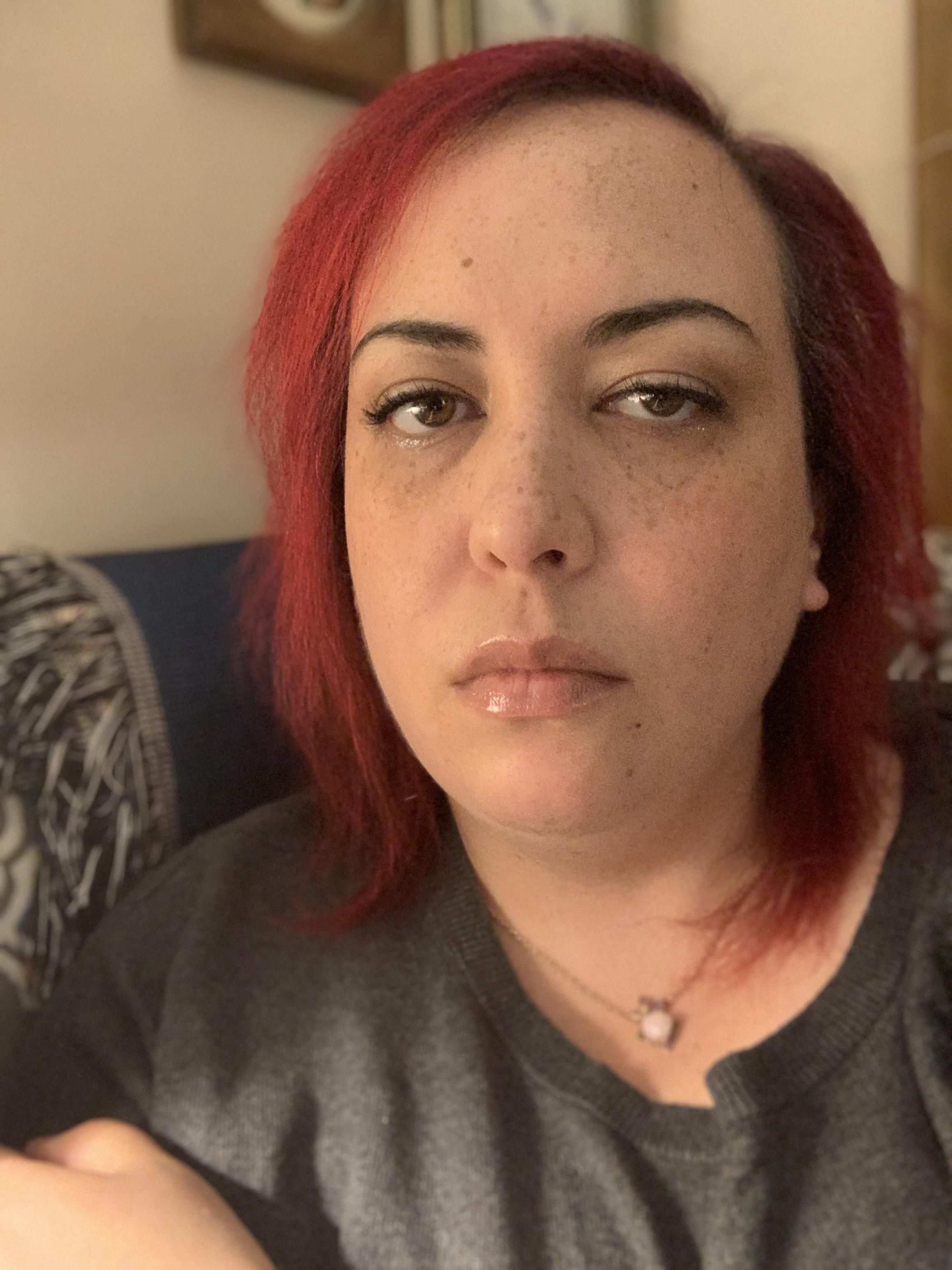 Serious face. Serious freckles. | Scrolller