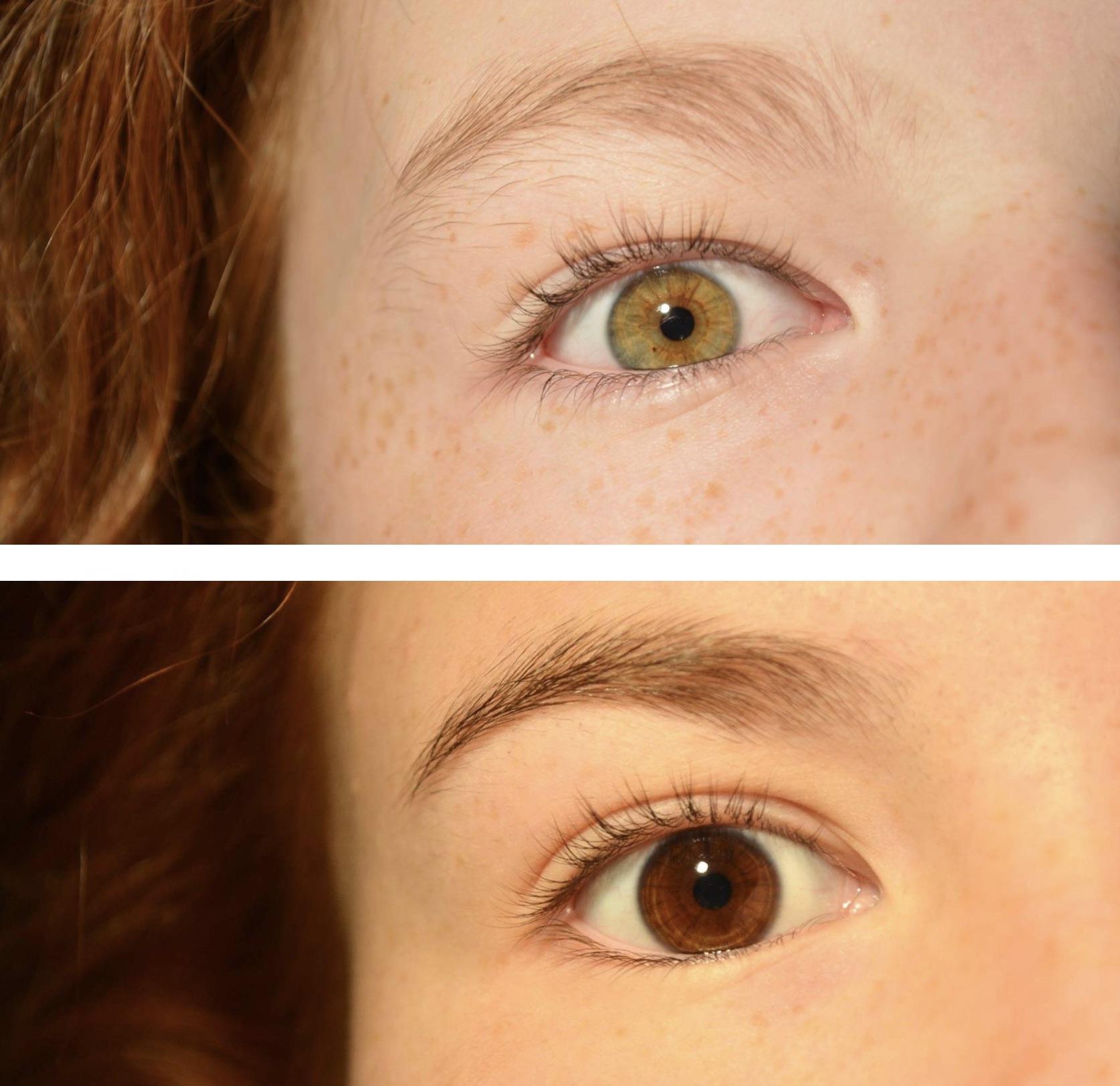 Sister’s eye and My eye. Very different colours but similar patterns/rings. | Scrolller