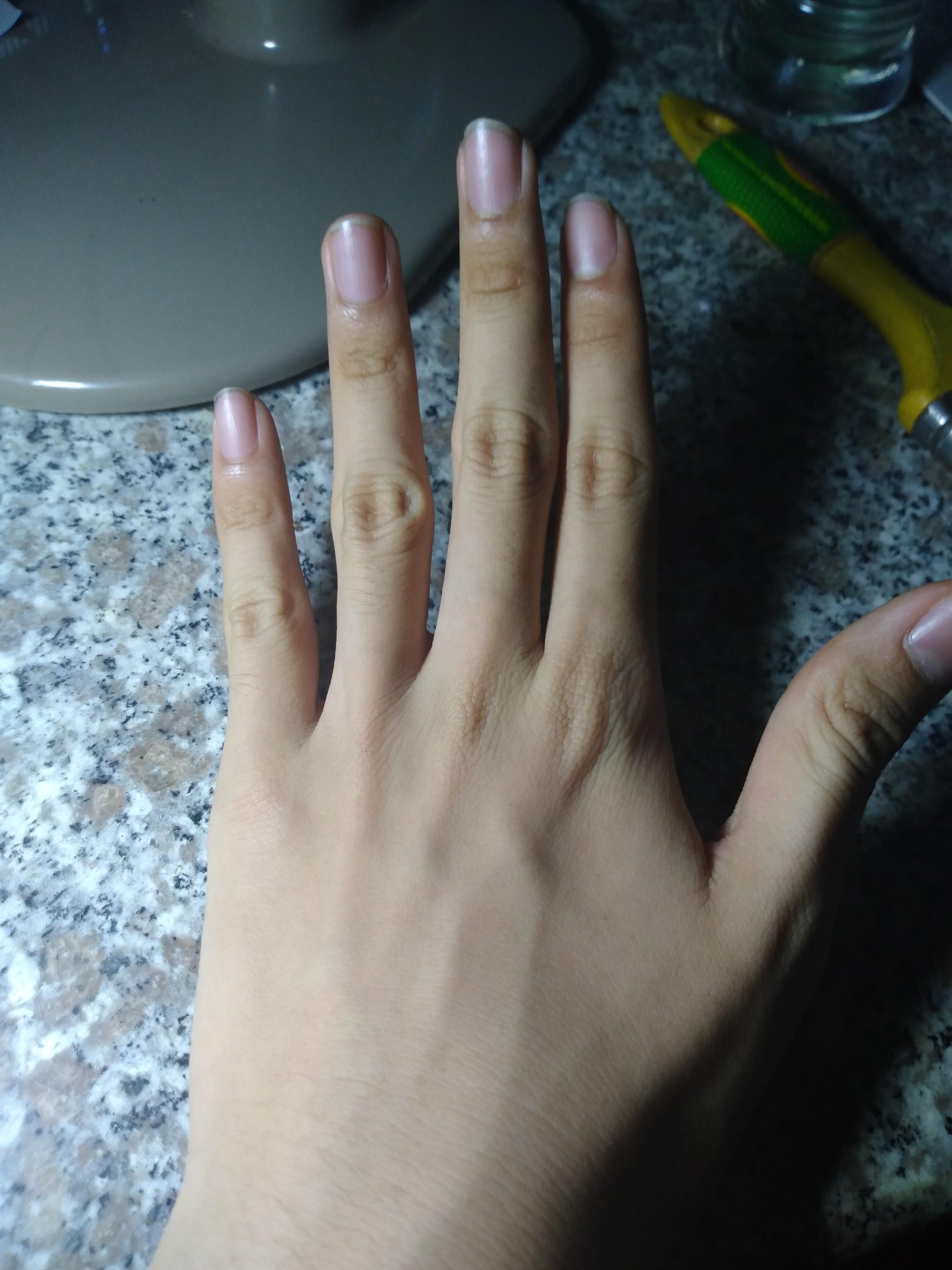 Skeletal hand (p2) | Scrolller