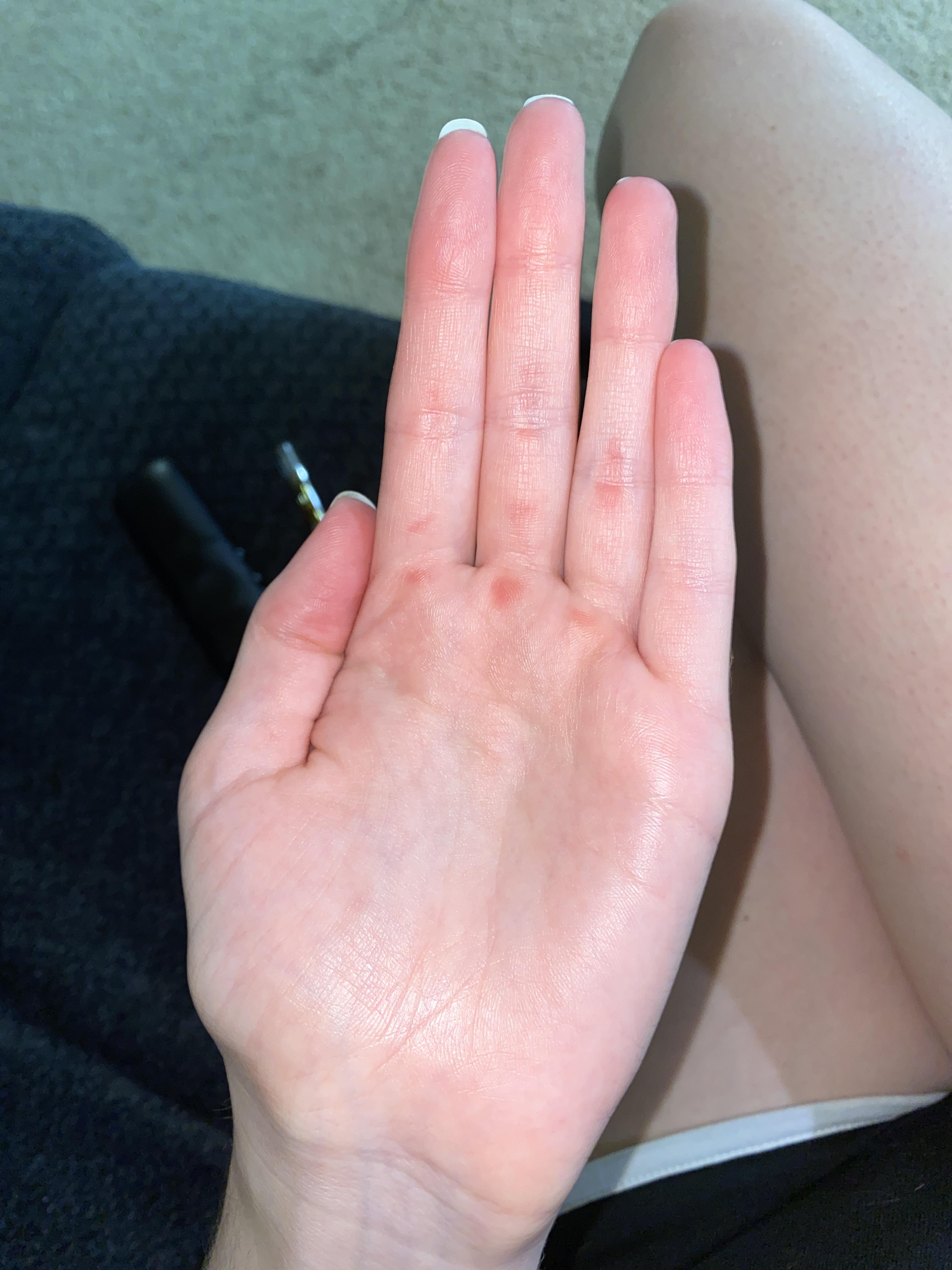 Soft palms 🤩 | Scrolller