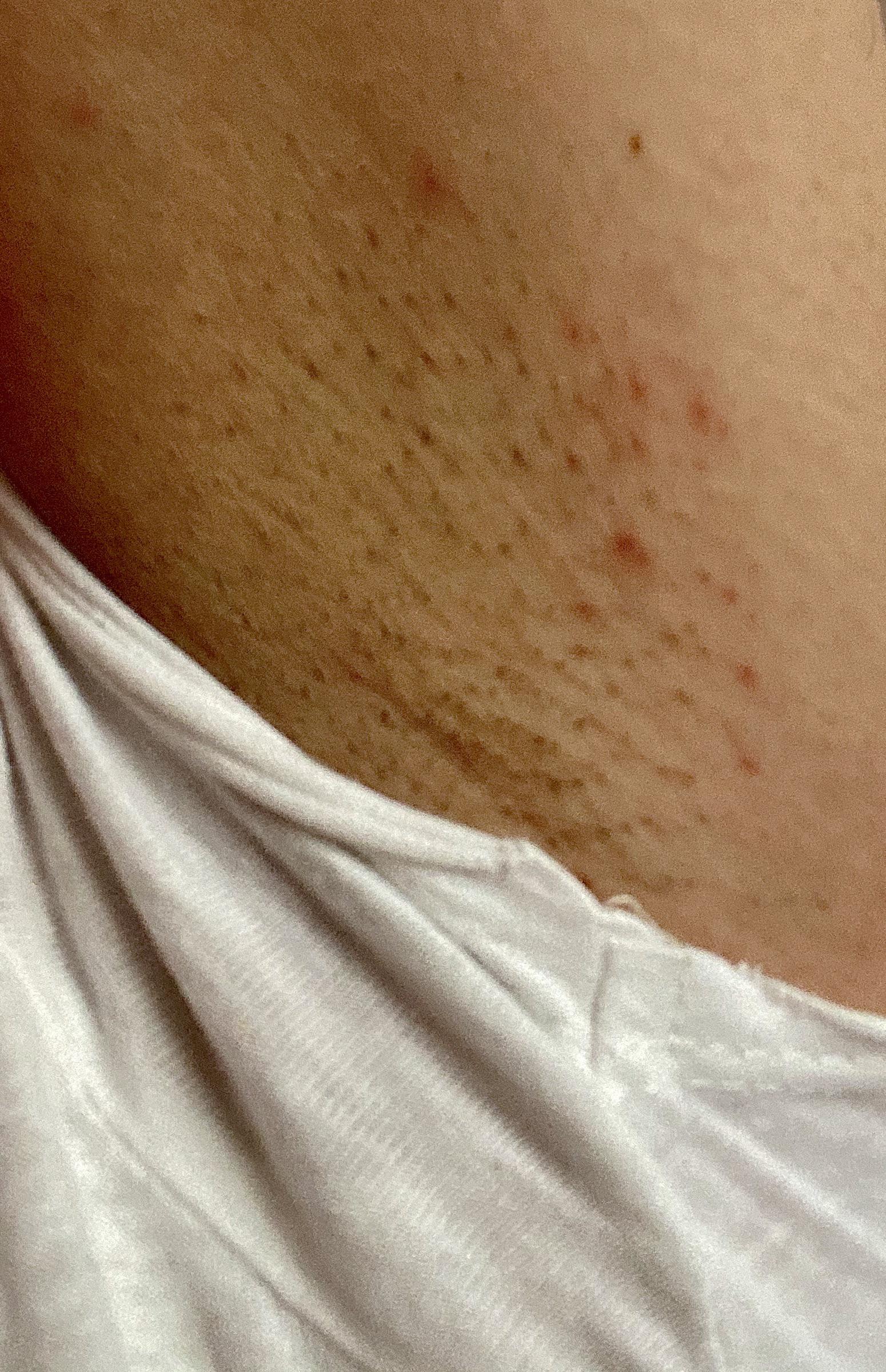 Some good morning stubbly pits for you | Scrolller