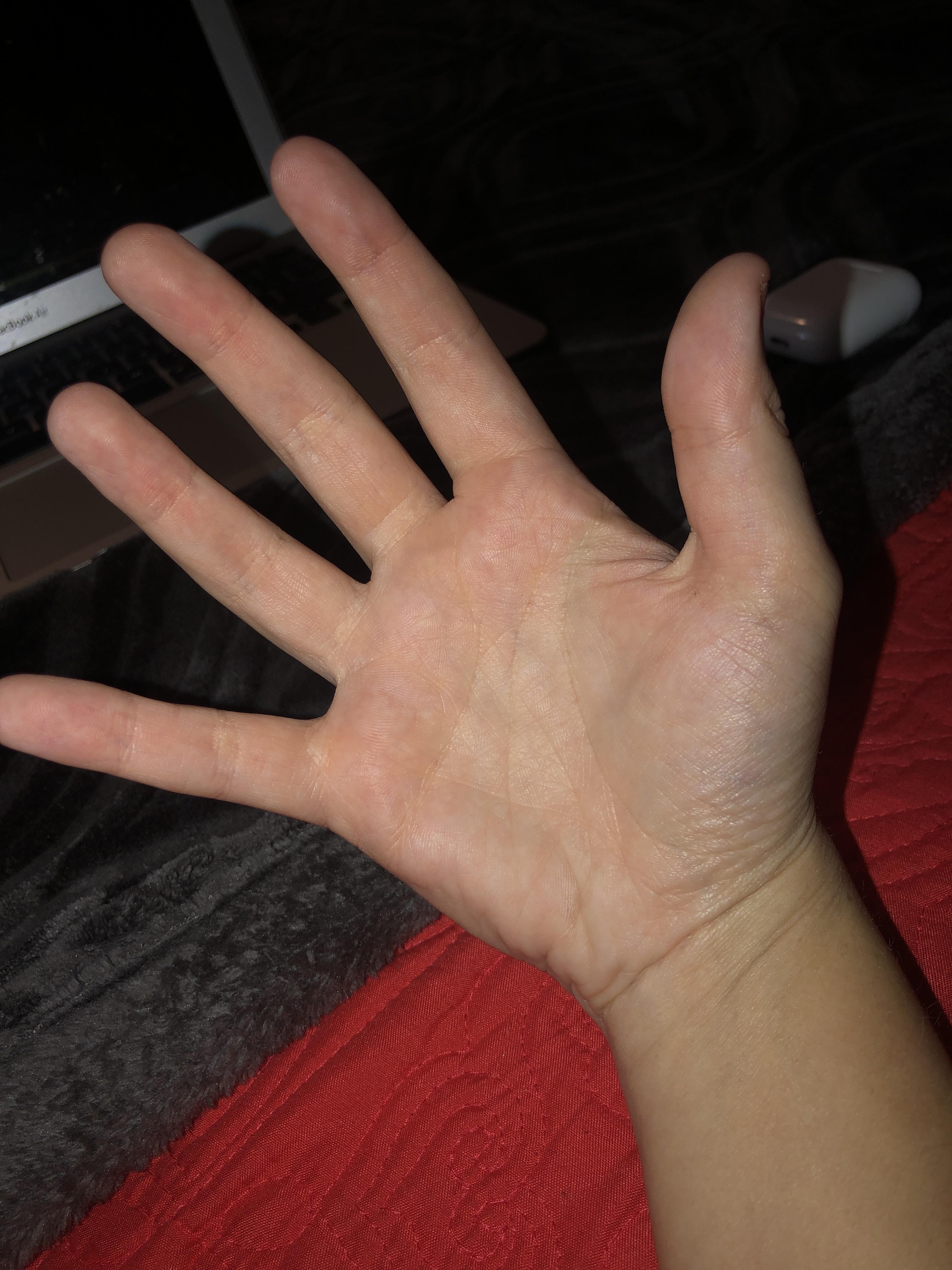 somebody rub the inside of my palms 🥺 | Scrolller