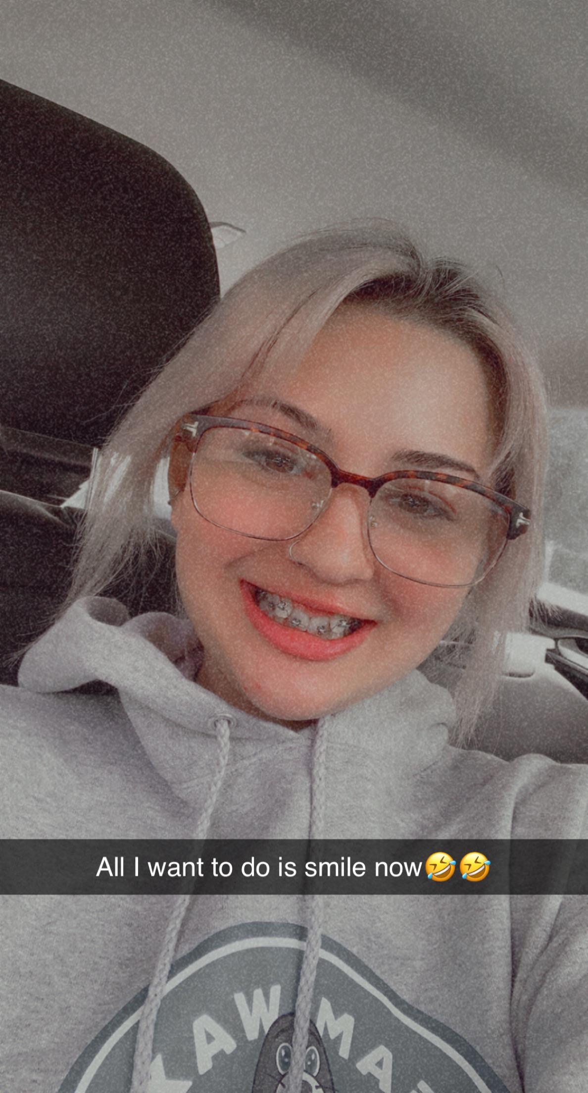 Stepping out of my comfort zone to show you all my new braces I’ve been waiting 10+ years for😃😂🦷 ...