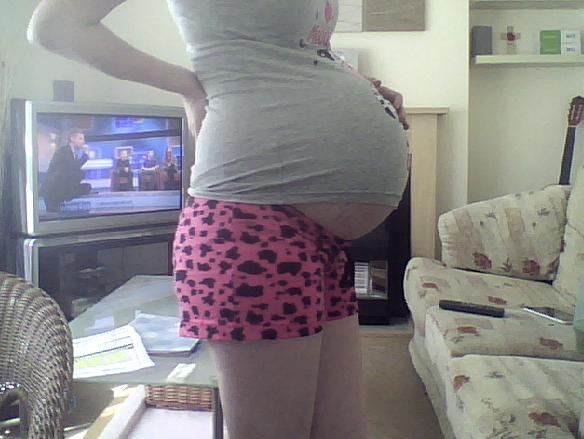 Stretch marks | Scrolller