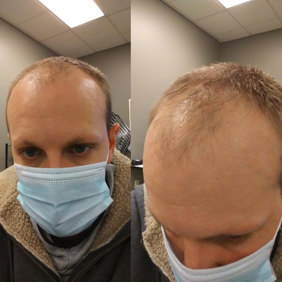 Styling tips or is it time to buzz/shave? | Scrolller