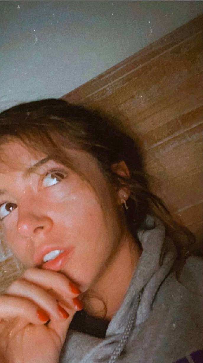 Sunburnt | Scrolller