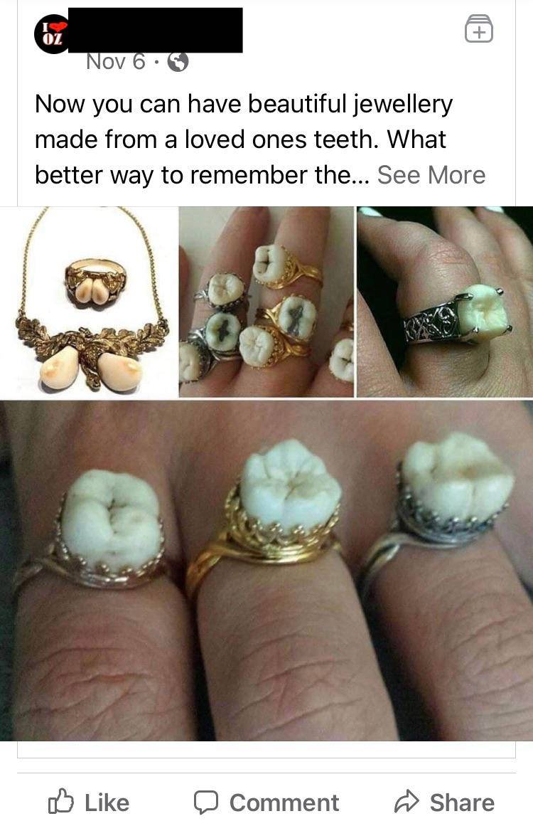 Teeth Jewelry? | Scrolller