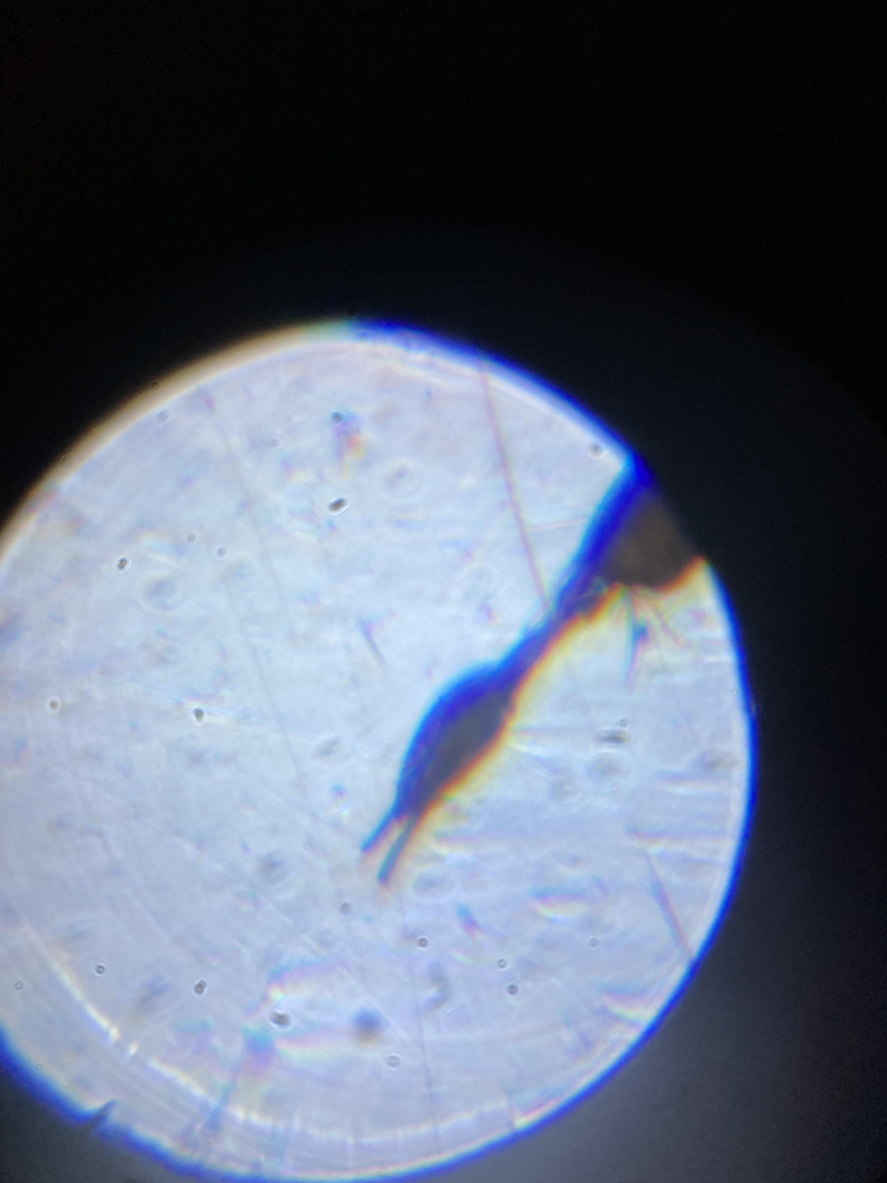 The leg/foot of a tick under a microscope | Scrolller