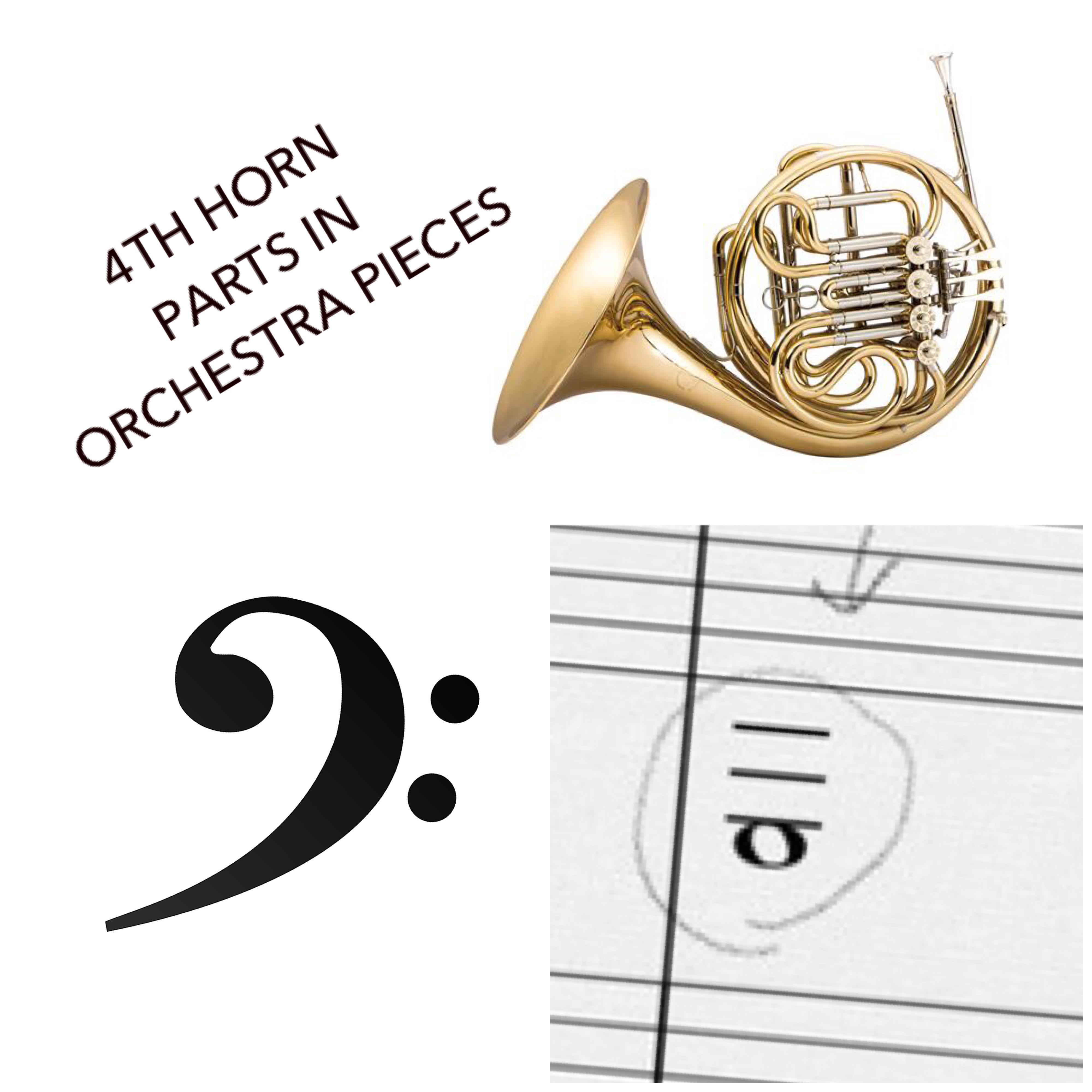 The struggle of the French hornists in orchestra | Scrolller