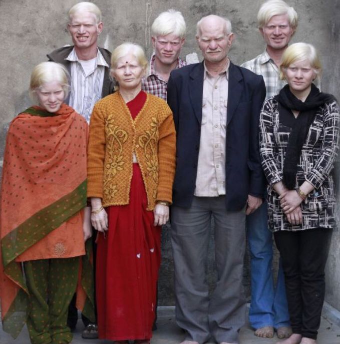 these currycels have evolved to albinomaxx so they can run JBW game | Scrolller