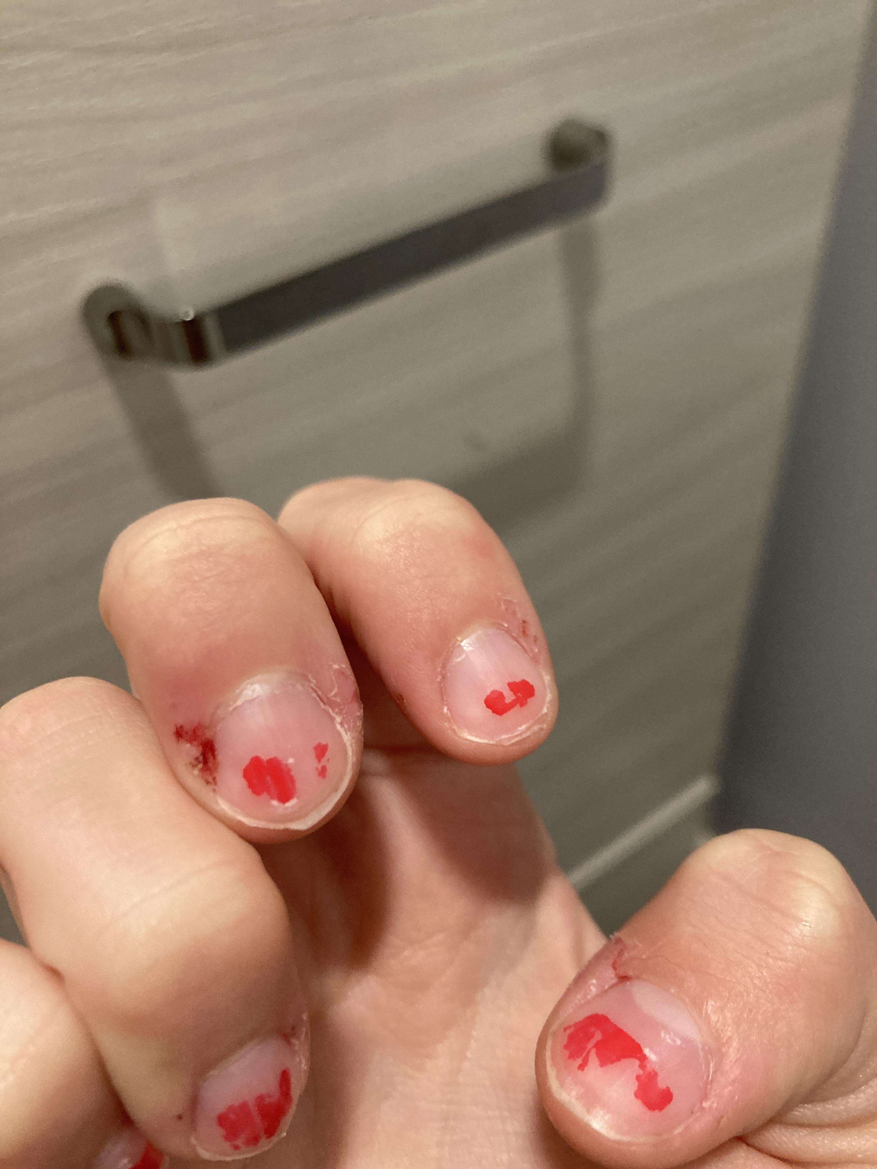 Theyre getting bad again :,) | Scrolller