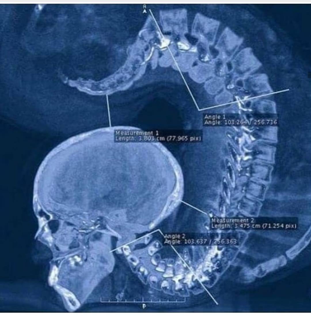 Thicc X-Ray | Scrolller