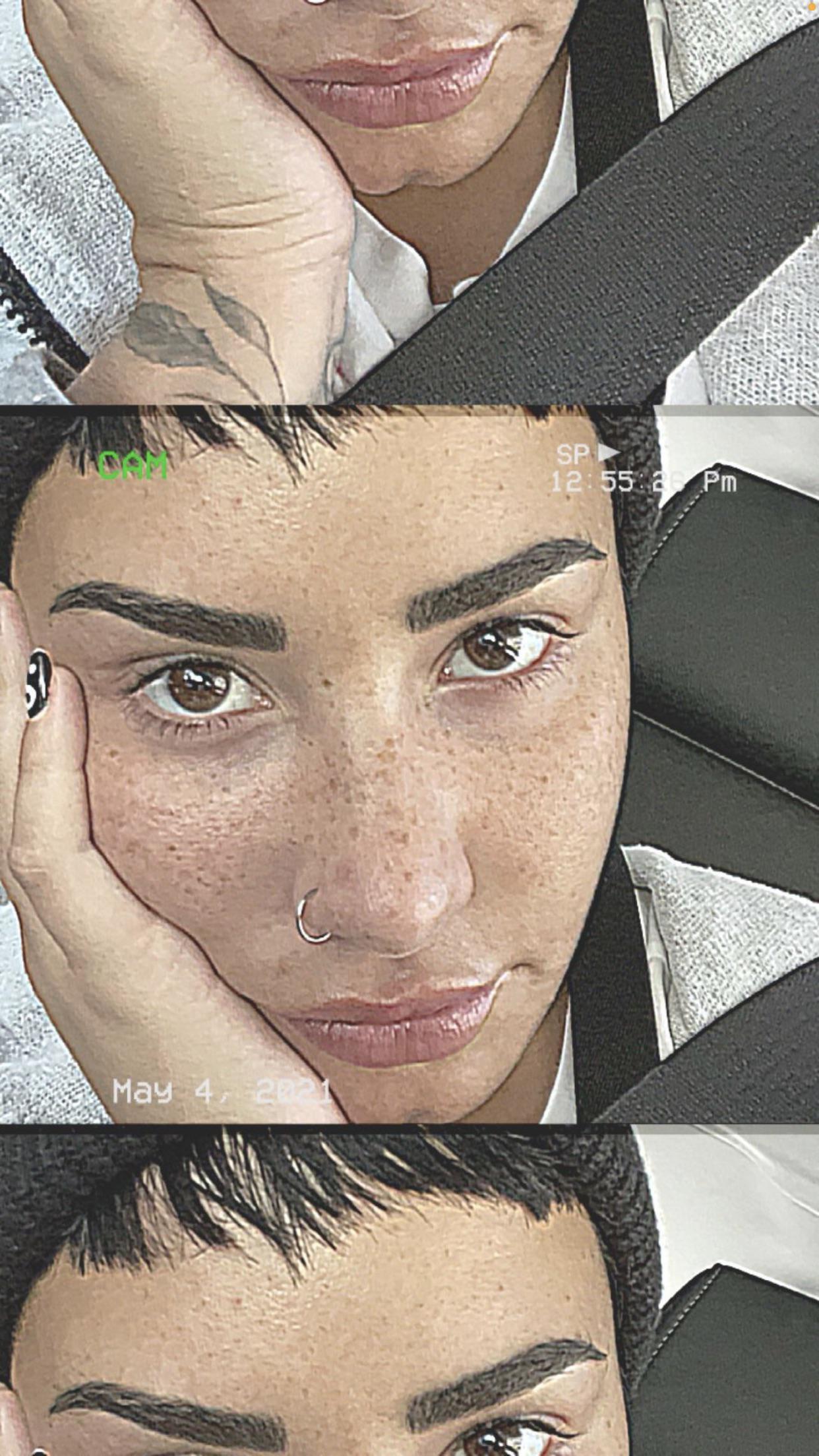 Those Freckles 😍😍😍 Scrolller