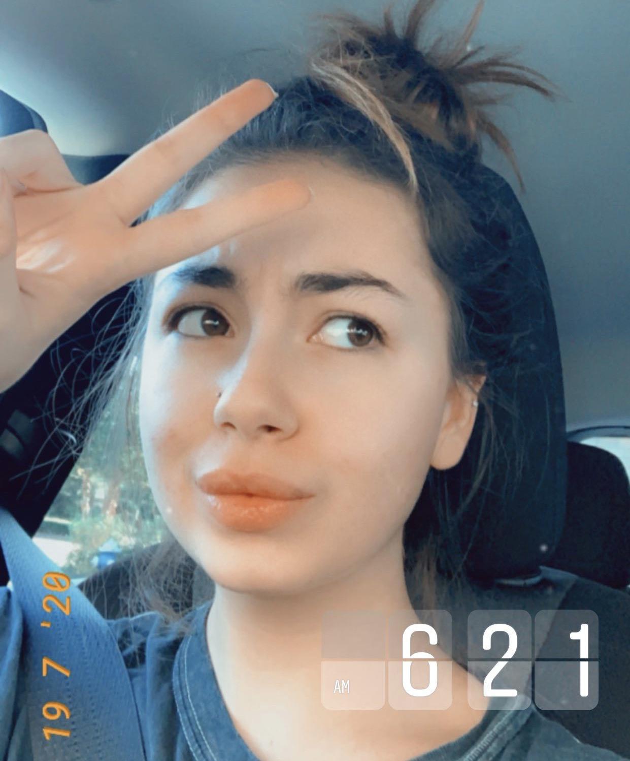 Those Lips 😍 | Scrolller