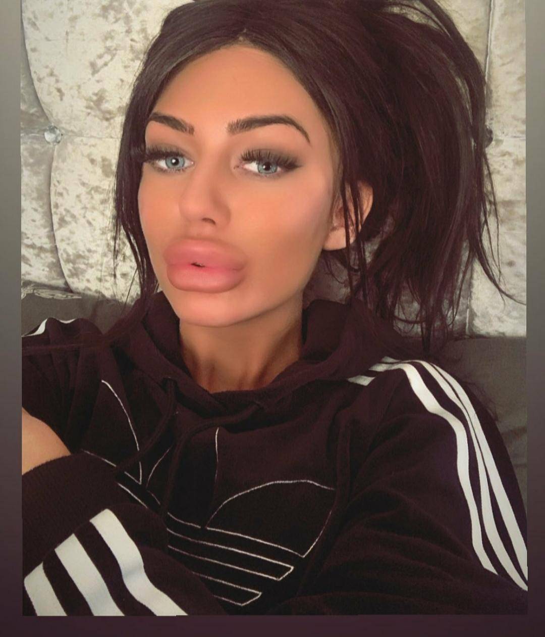 Those Lips | Scrolller