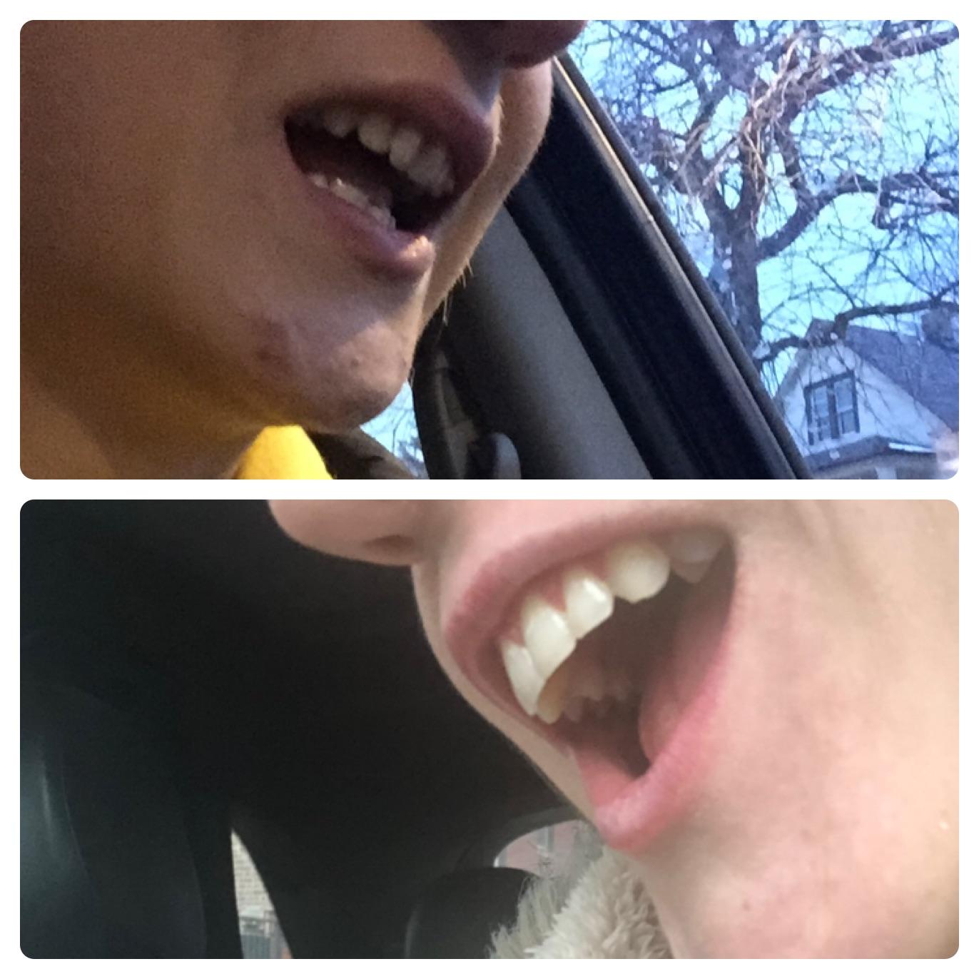 Three long years later! | Scrolller