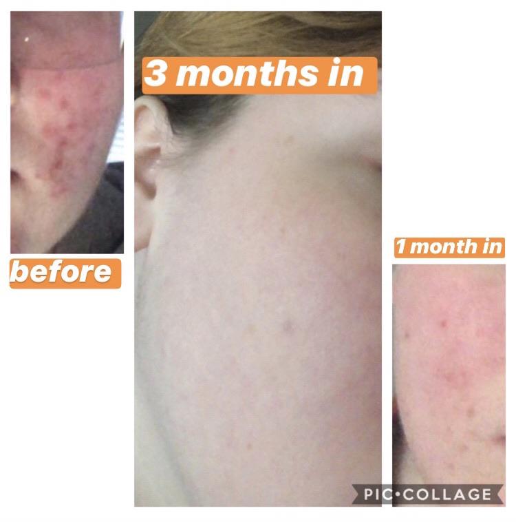 three months progress mark!! | Scrolller