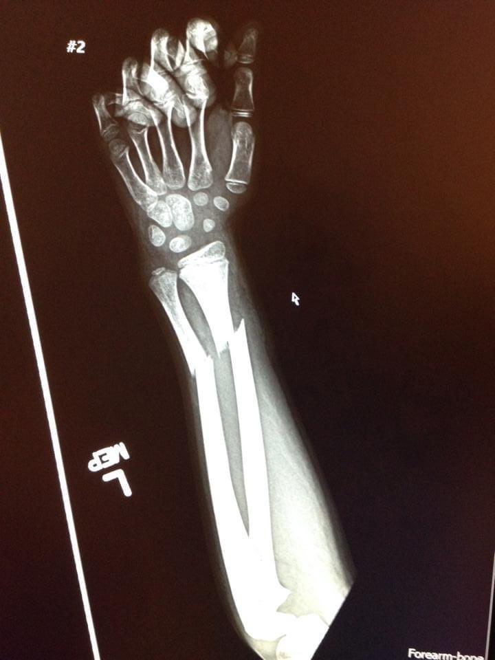 Trip to the playground gone wrong. | Scrolller