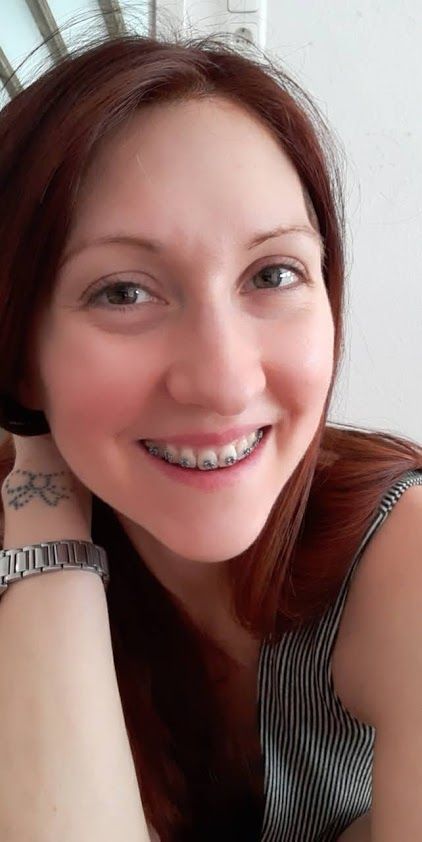 Up close and personal with the braces! | Scrolller