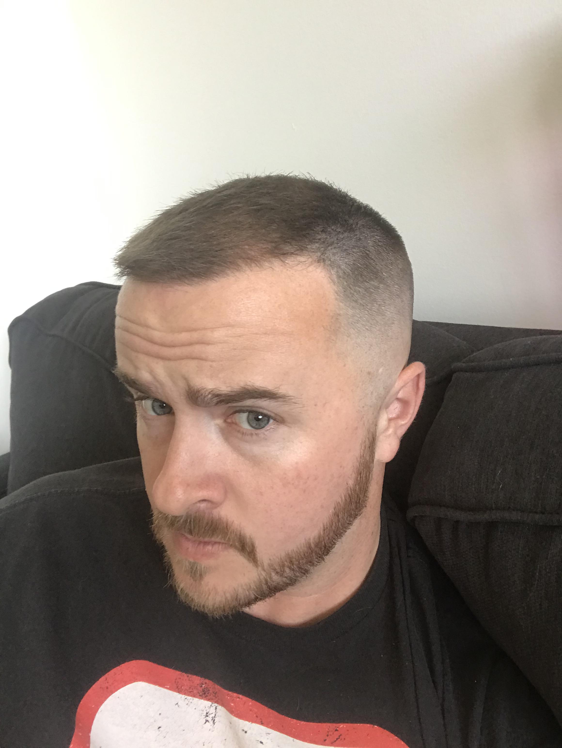 Update: skin fade and a good line-up are the solution to all things. | Scrolller