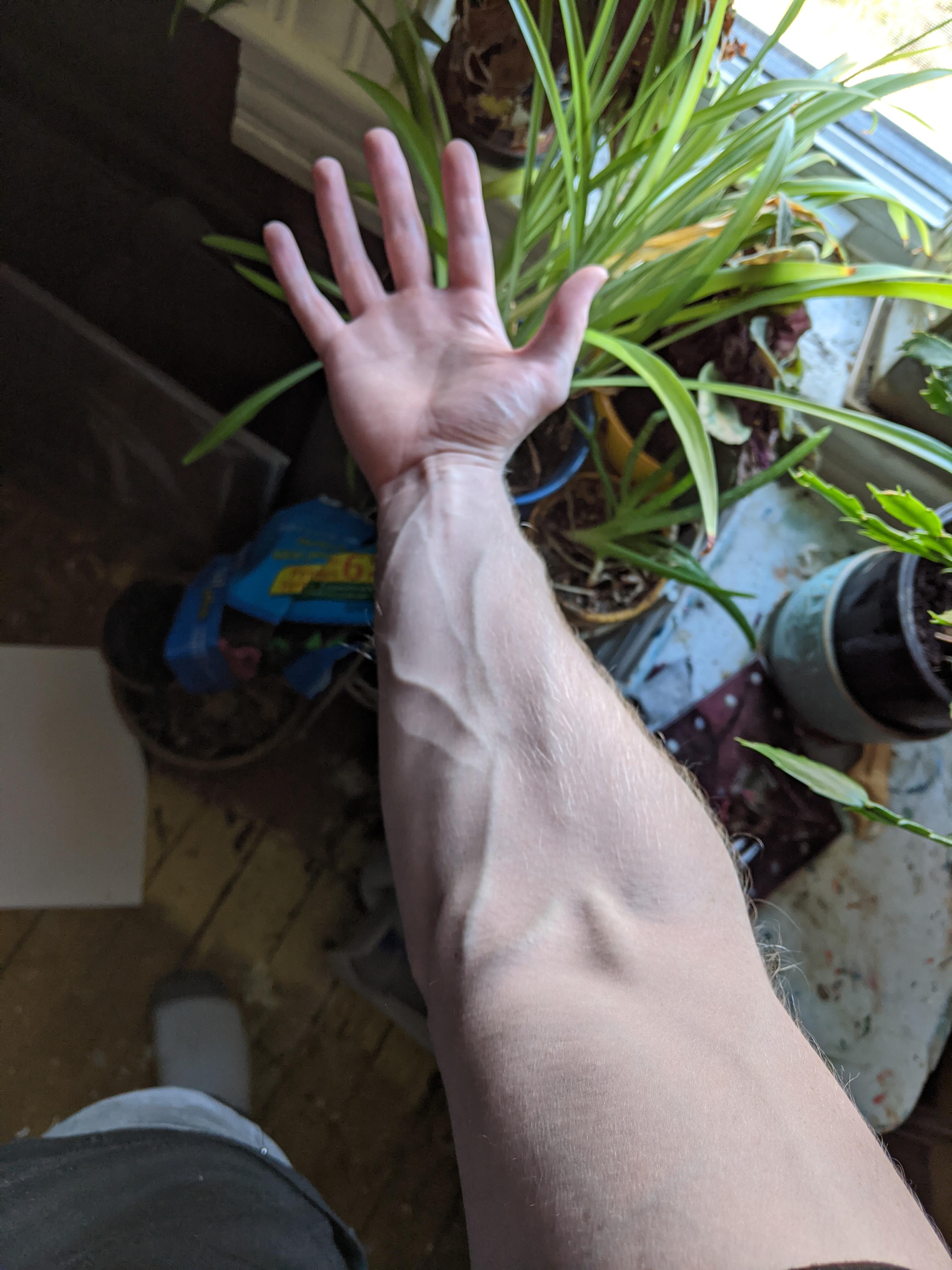 Veins and plants | Scrolller