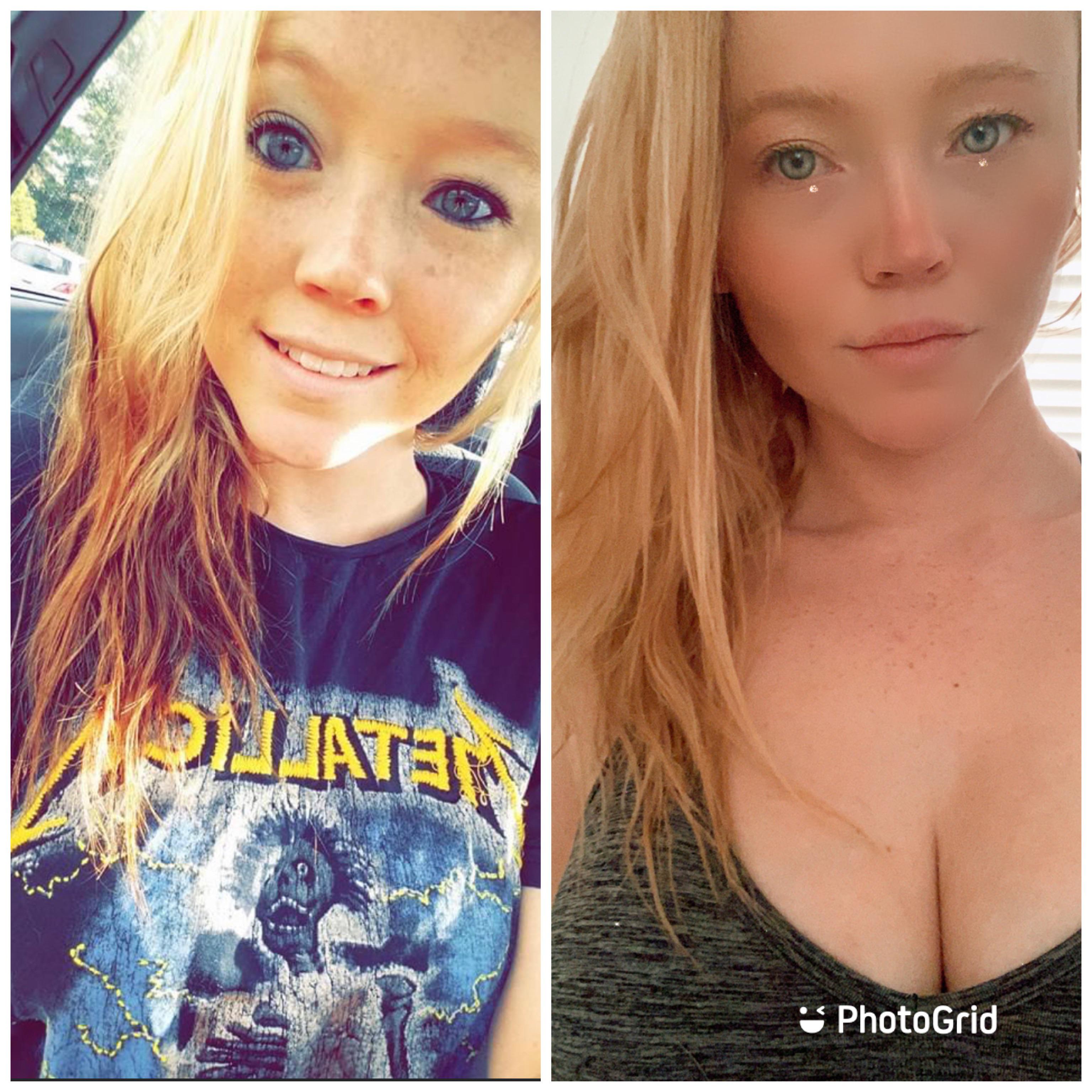 Weird how your freckles start to fade as you get older. | Scrolller