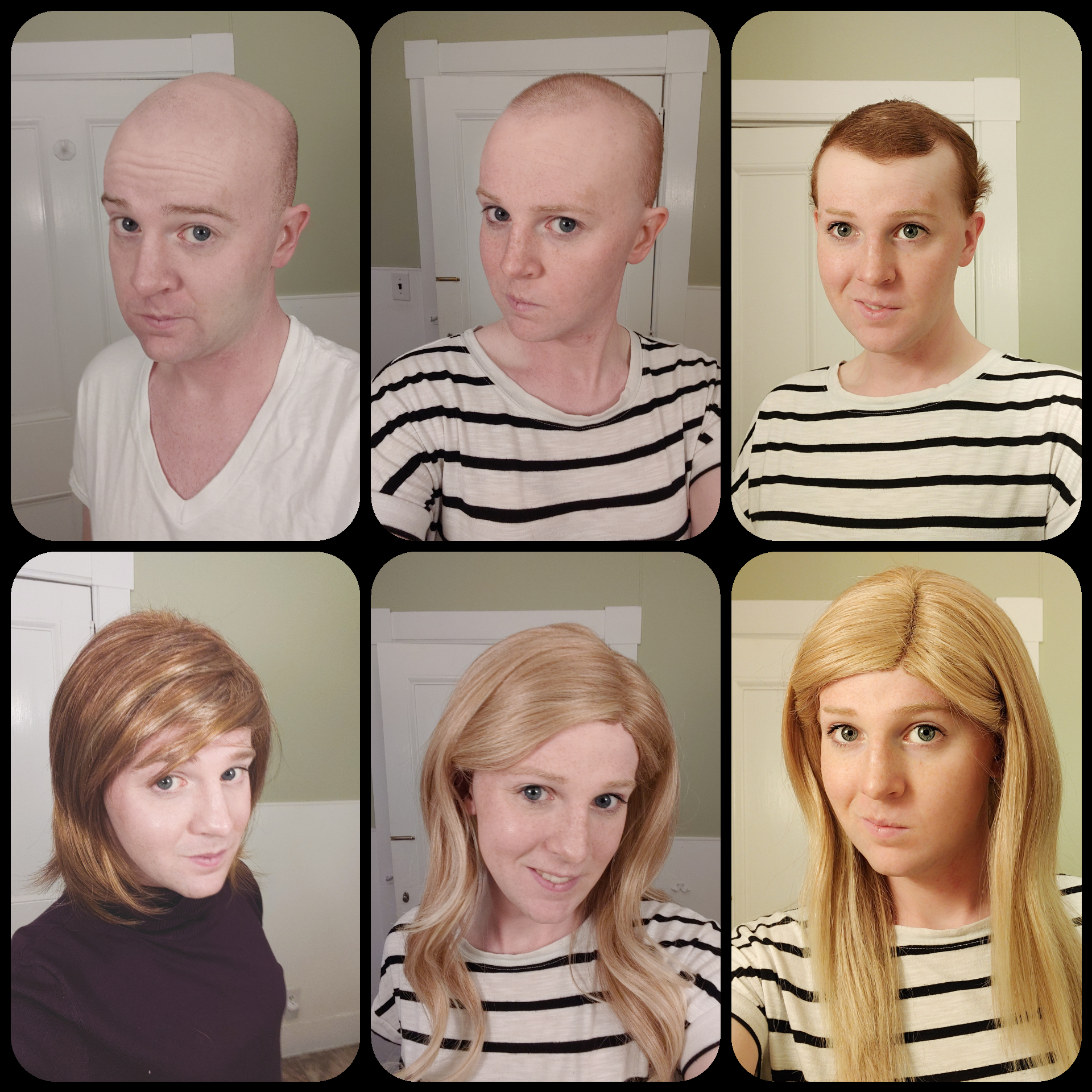 What a difference! 25 MTF | Scrolller