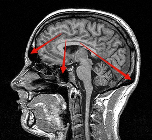 What are these structures in the head called? | Scrolller