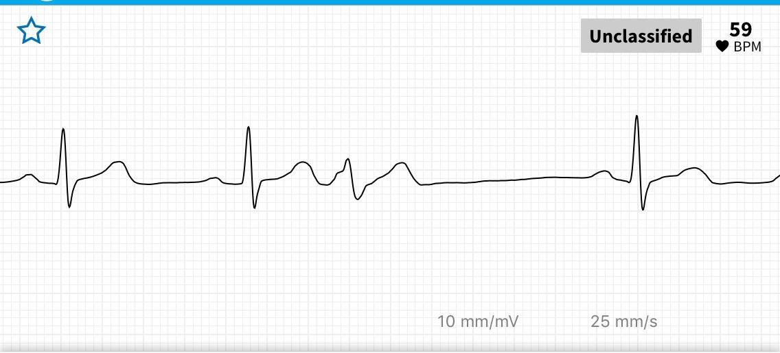 What might cause this weird wave? (Details in comment) | Scrolller