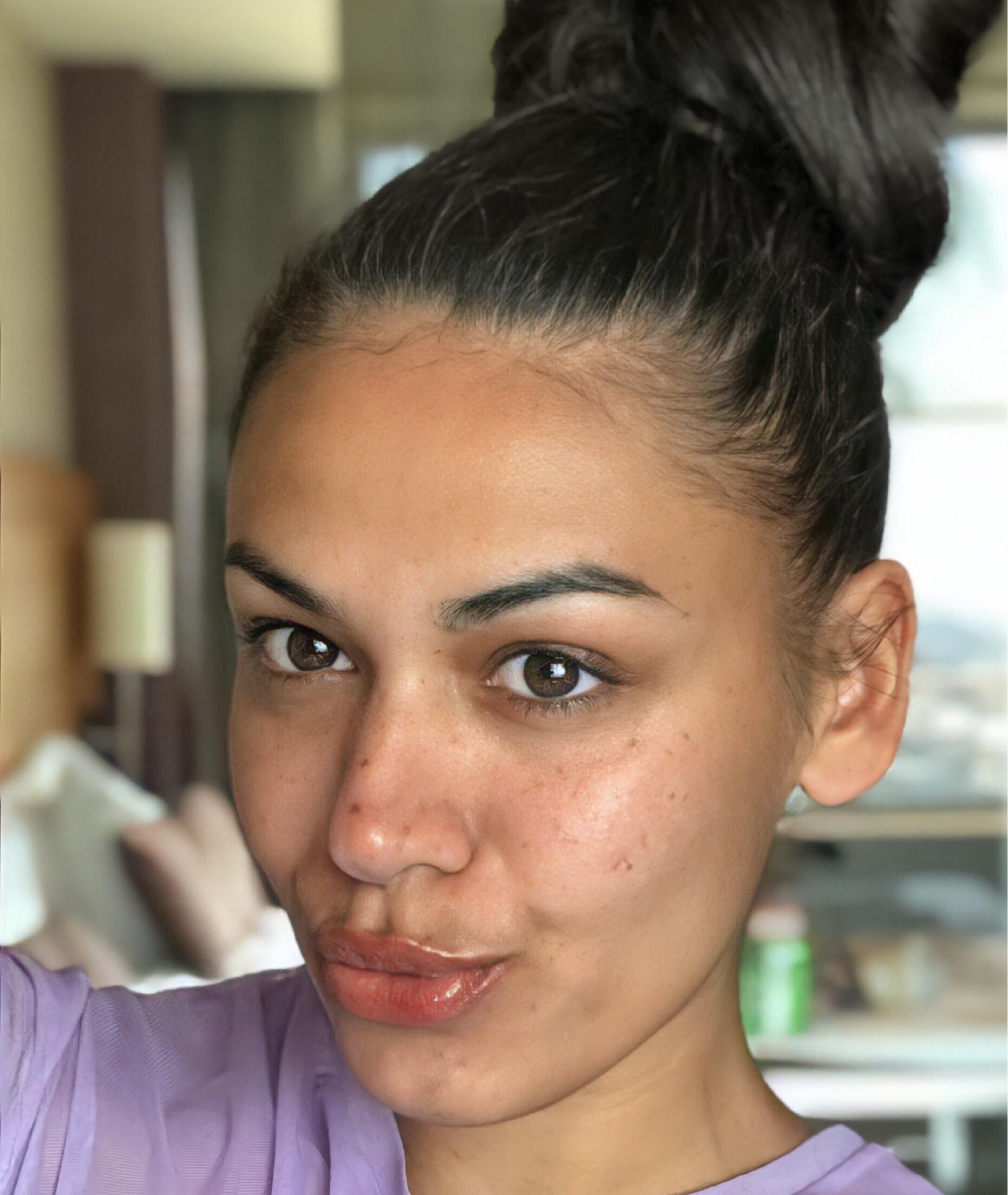Who Likes Freckles Scrolller