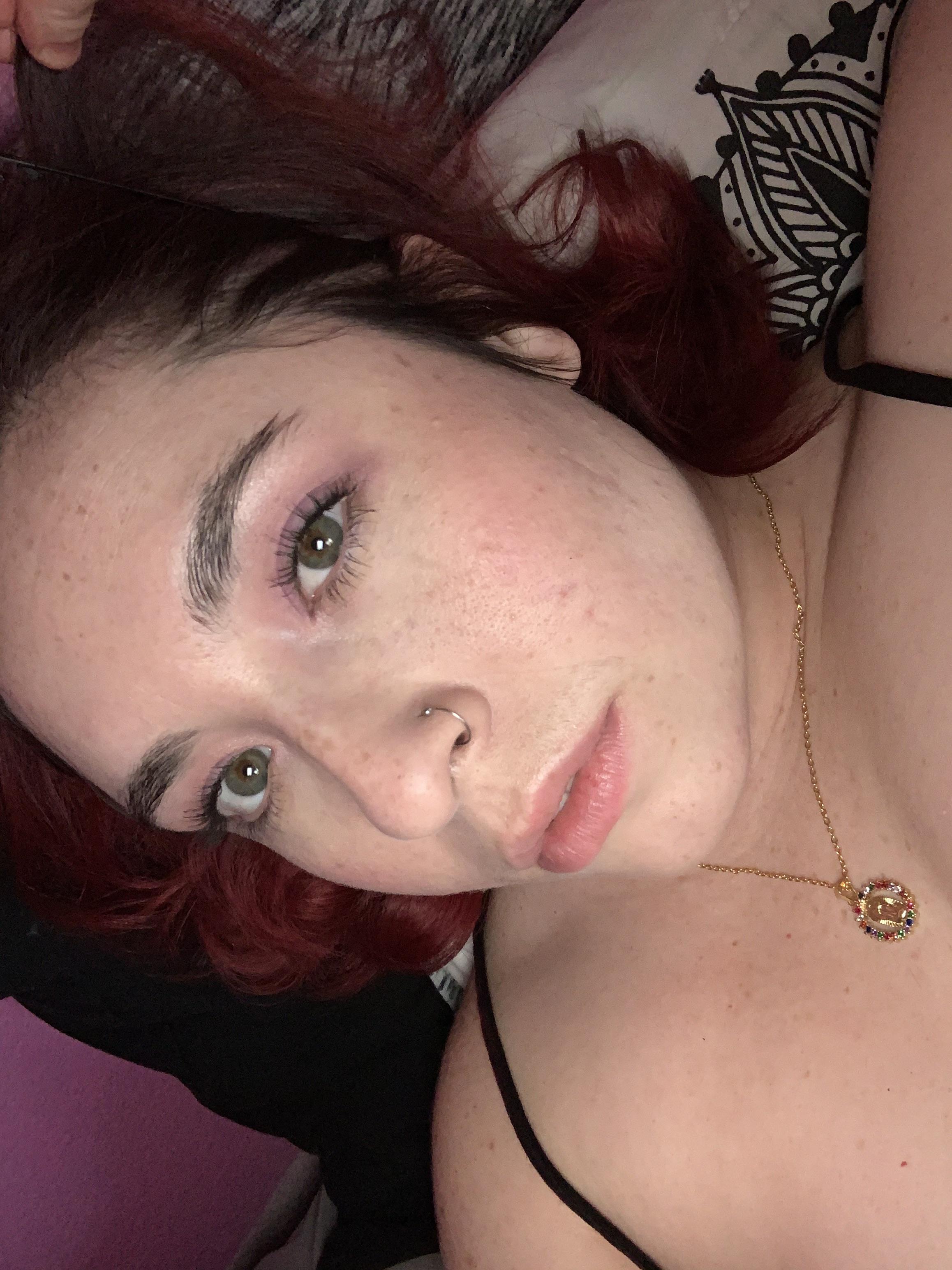 winter freckles | Scrolller