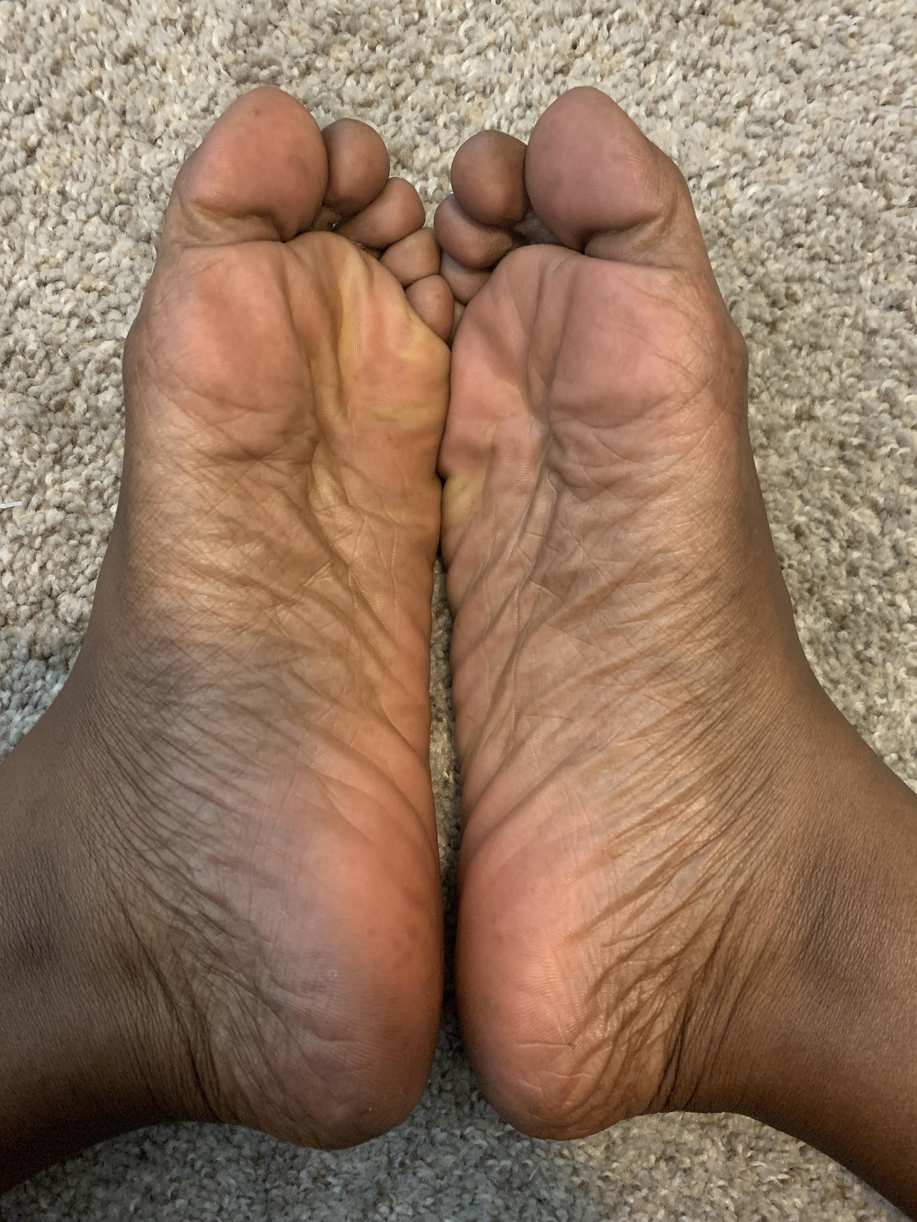 Wrinkles 😍 | Scrolller