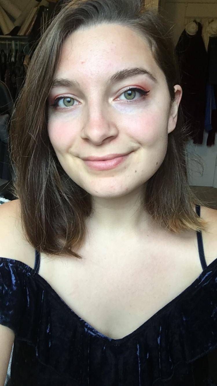 Yeah green eyes are pretty, but do they have to be so sensitive to sunlight? | Scrolller